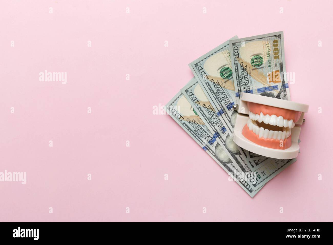 Closeup model of a human jaw with white teeth and dollar bill ...