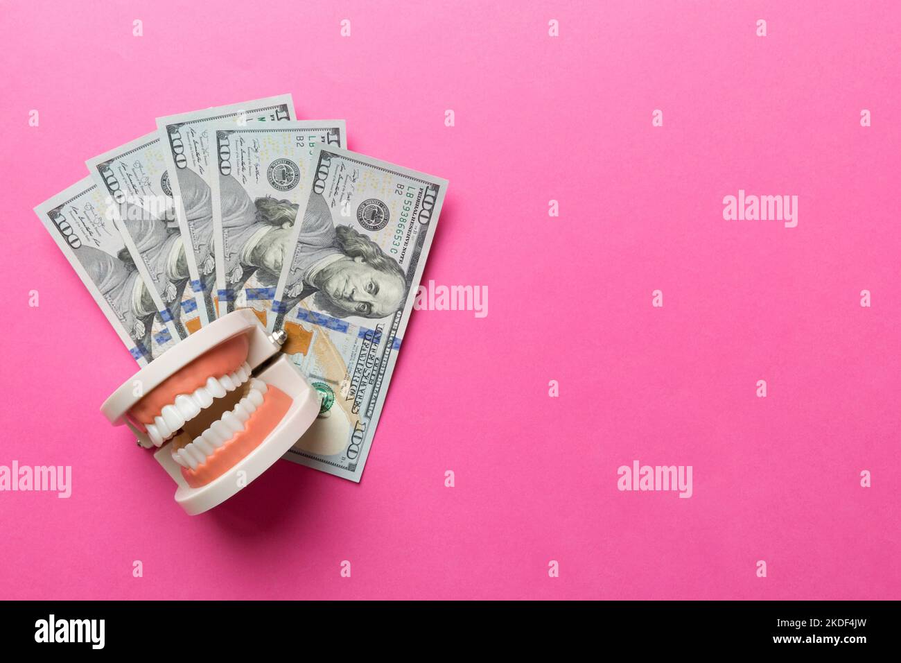 Closeup model of a human jaw with white teeth and dollar bill ...