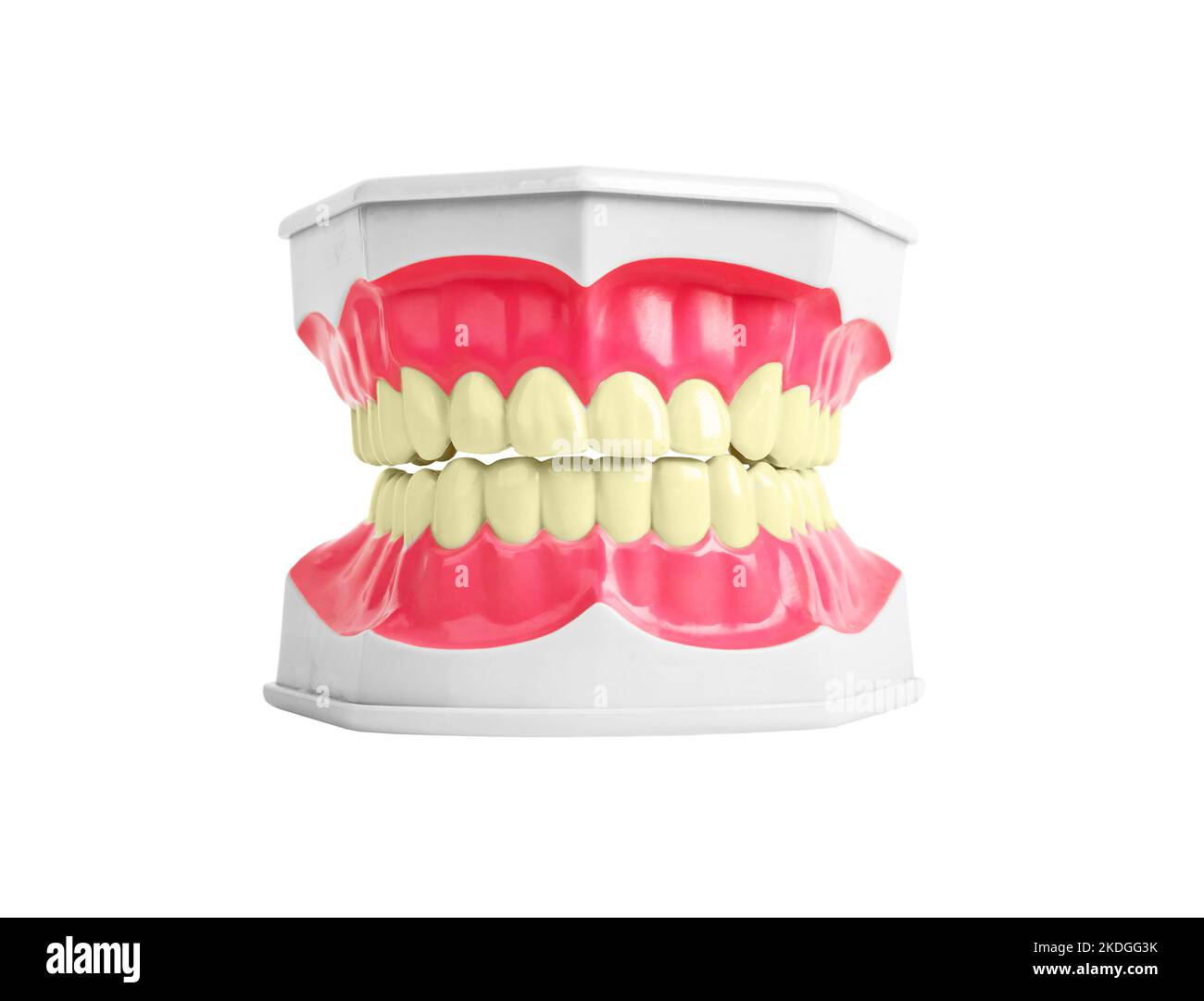 Unhealthy bad teeth of yellow color with caries dental disease. Jaw ...