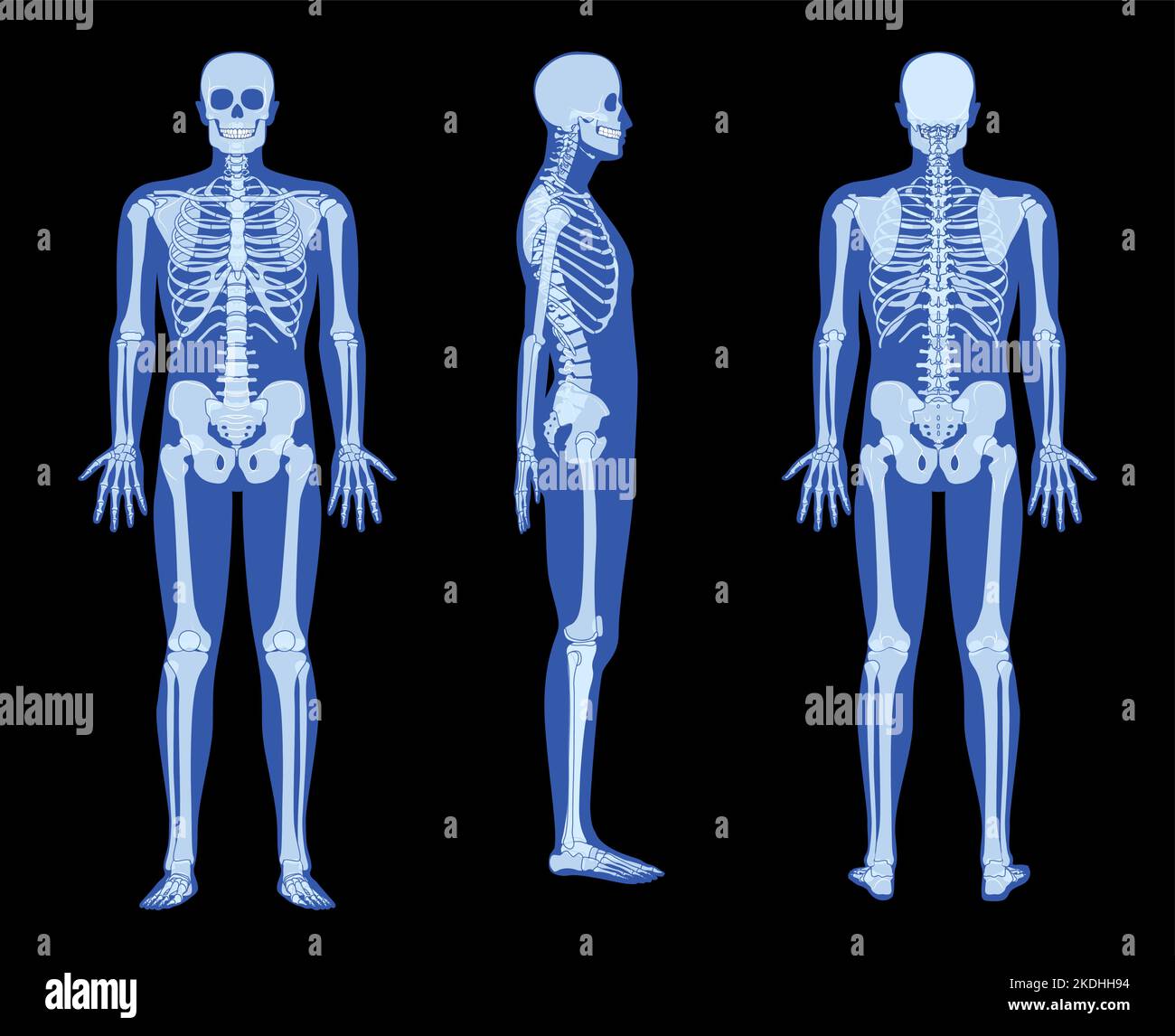 Set of X-Ray Skeleton Human body - hands, legs, chests, heads, vertebra ...