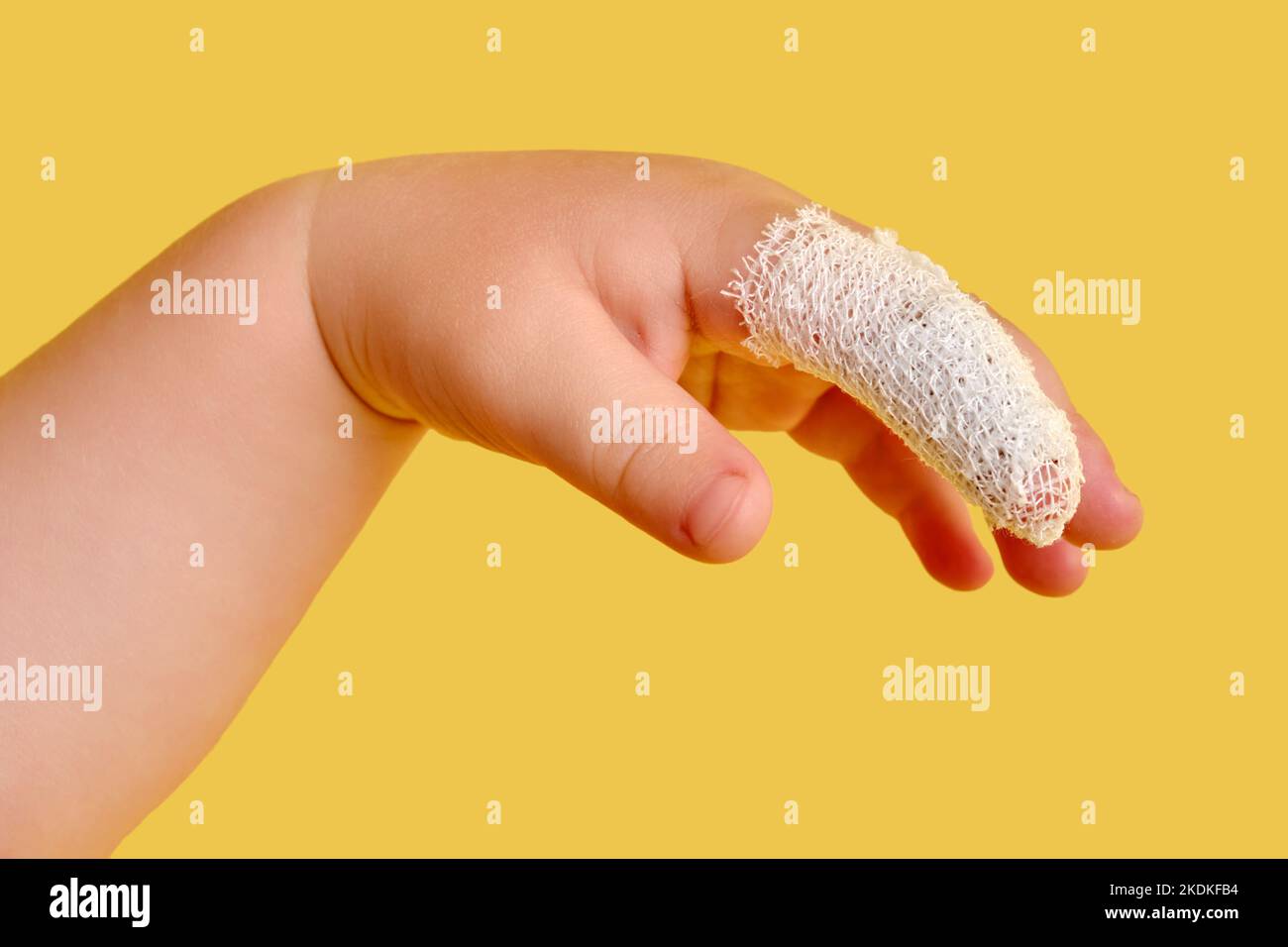 Baby s hand with a bandaged finger on a yellow studio background, close ...