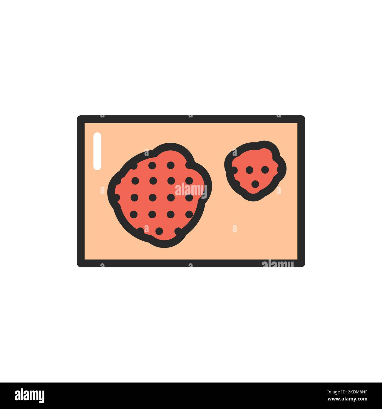 Eczema drawing hi-res stock photography and images - Alamy