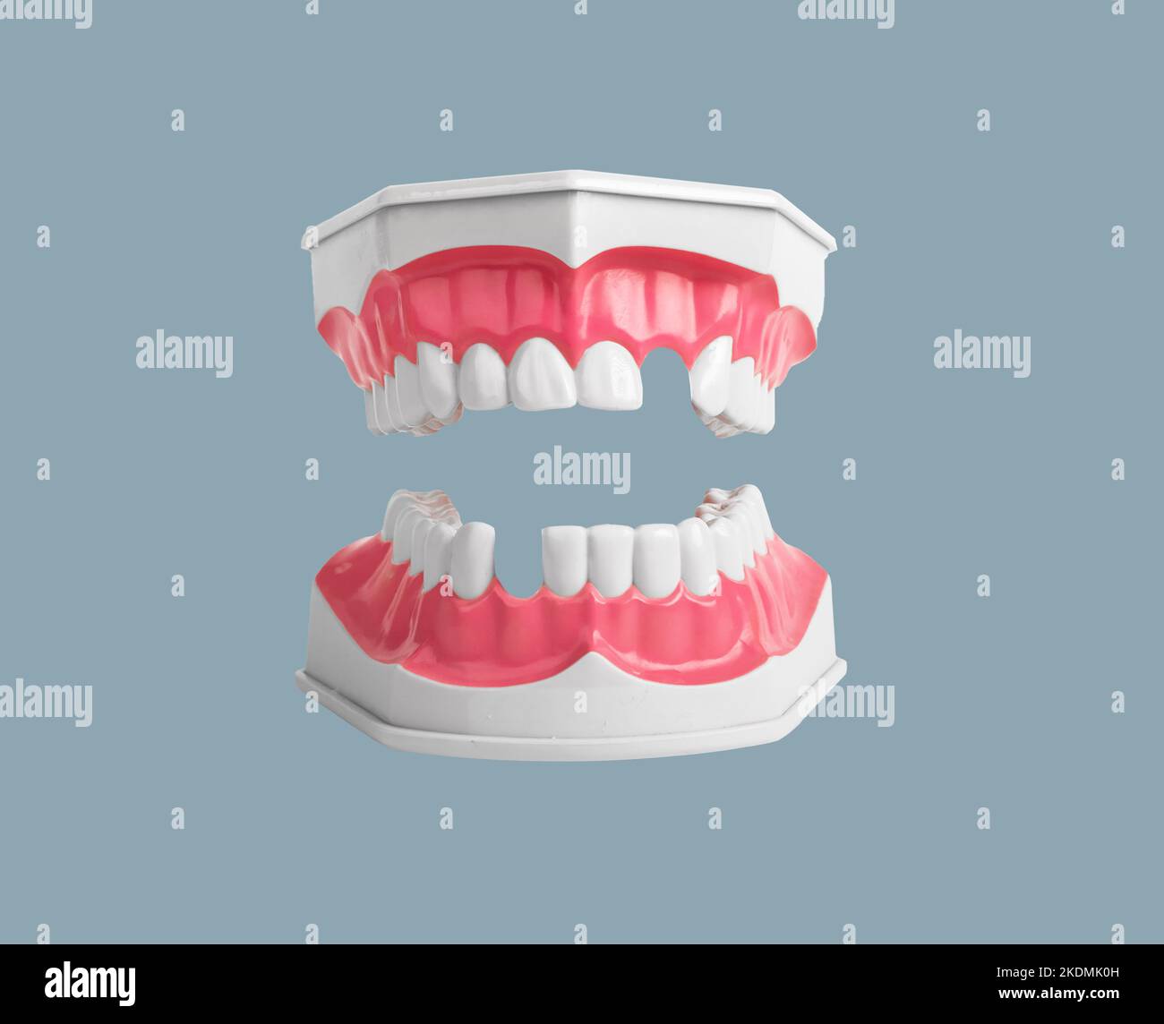 Loss of teeth concept. Missing, abscence of tooth in abstrac dental ...