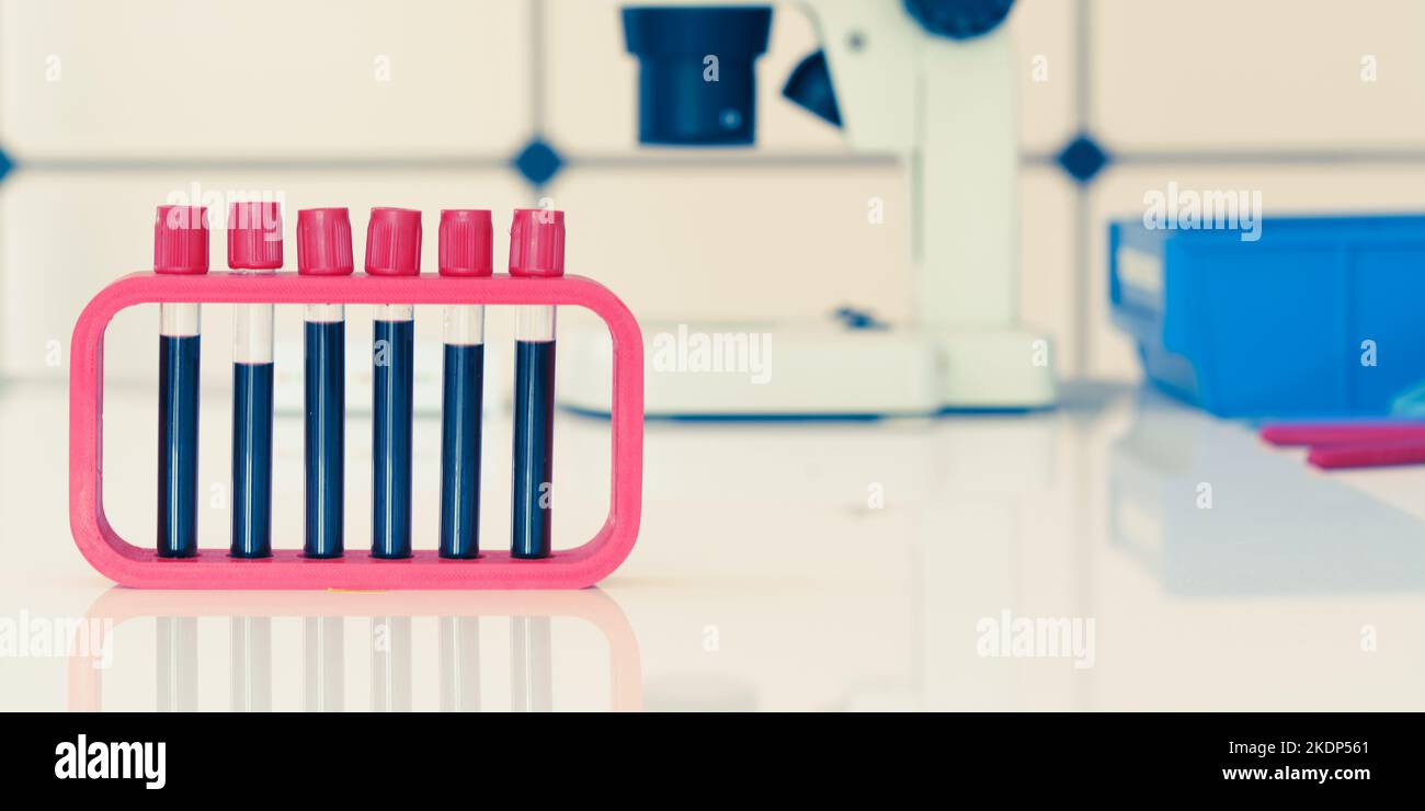 Blood test for hormones and microelements in a biochemical laboratory ...