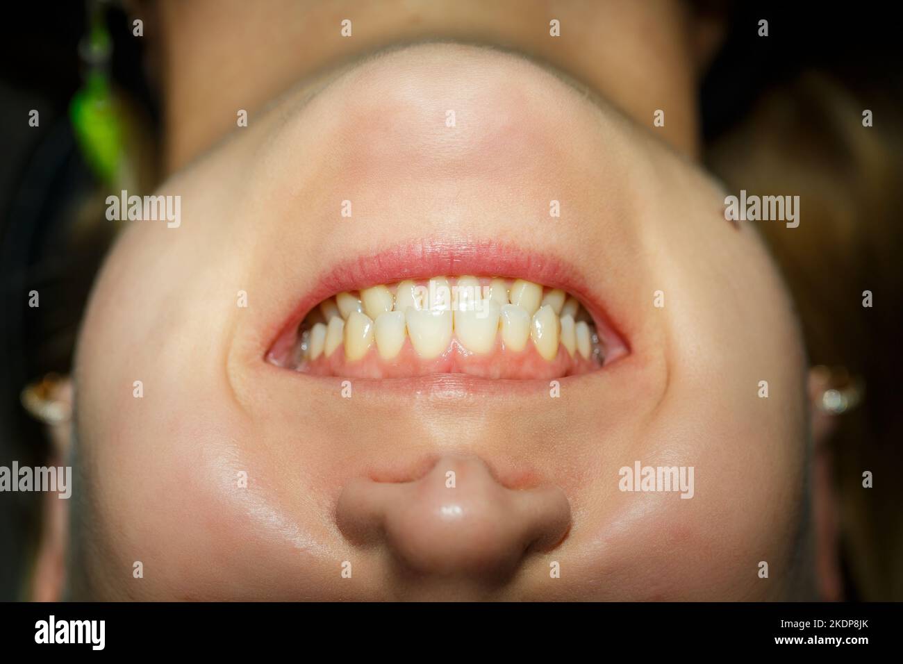 Close-up teeth, dental treatment at the dentist. Oral cavity care Stock ...