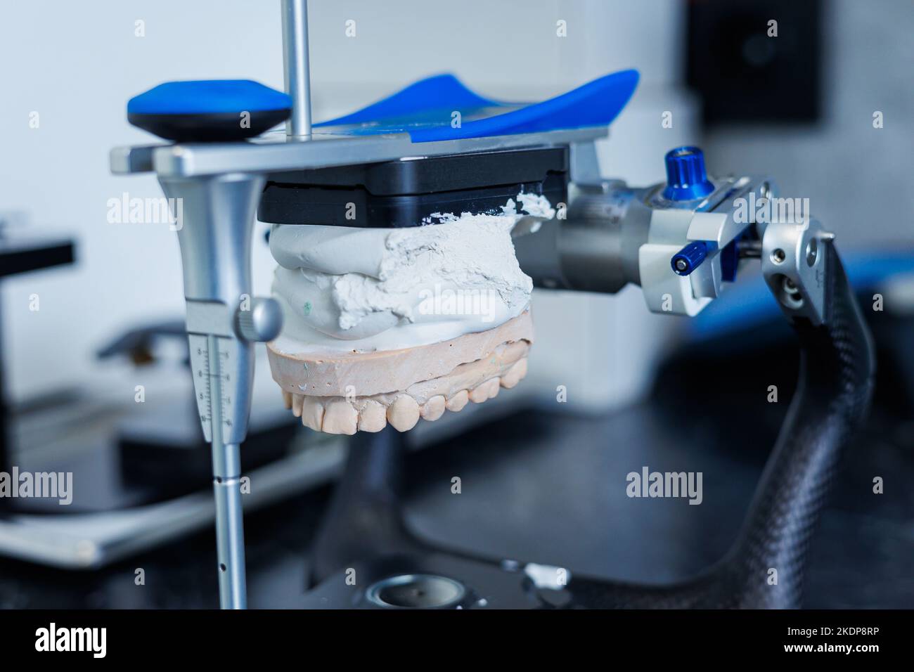 Plaster cast of the jaw with teeth. Modern dental office Stock Photo ...