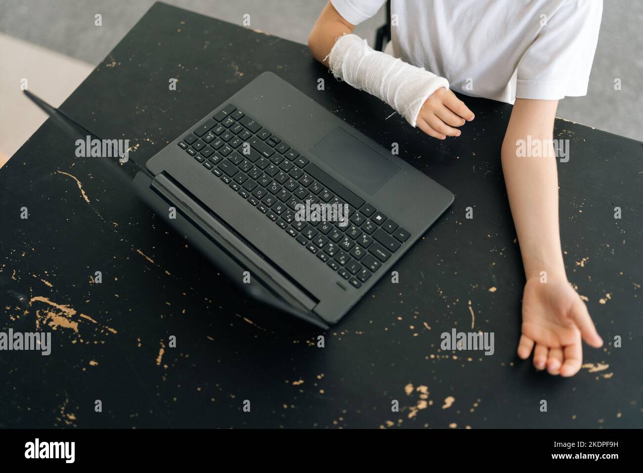 Close-up top view of unrecognizable little girl with broken hand ...