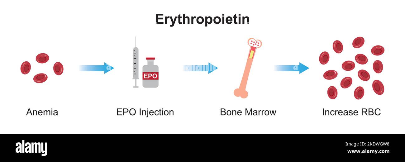 Scientific Designing of Erythropoietin (EPO) Effect on Bone After ...