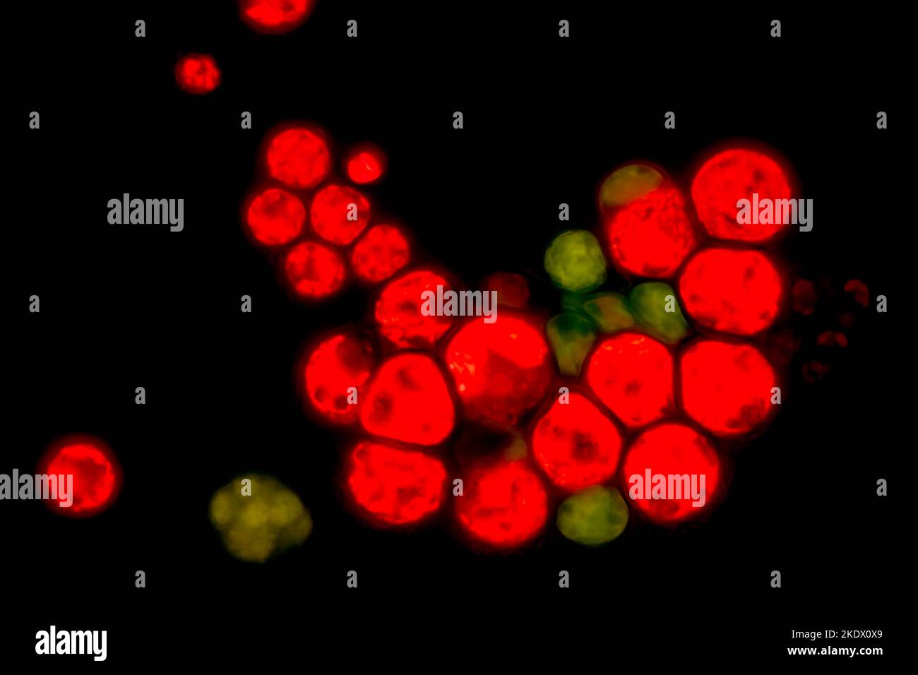 Coenochloris fottii cf. algae, light micrograph Stock Photo - Alamy