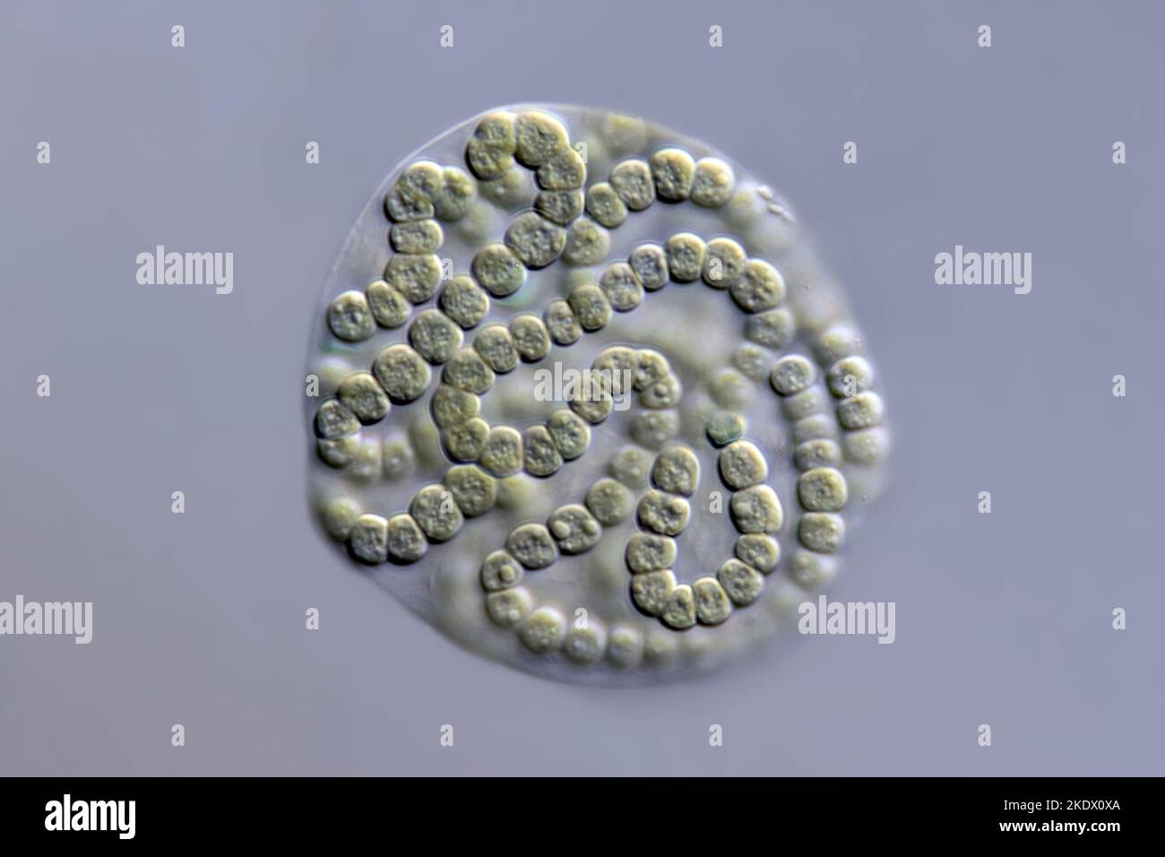 Nostoc-like cyanobacteria, light micrograph Stock Photo - Alamy