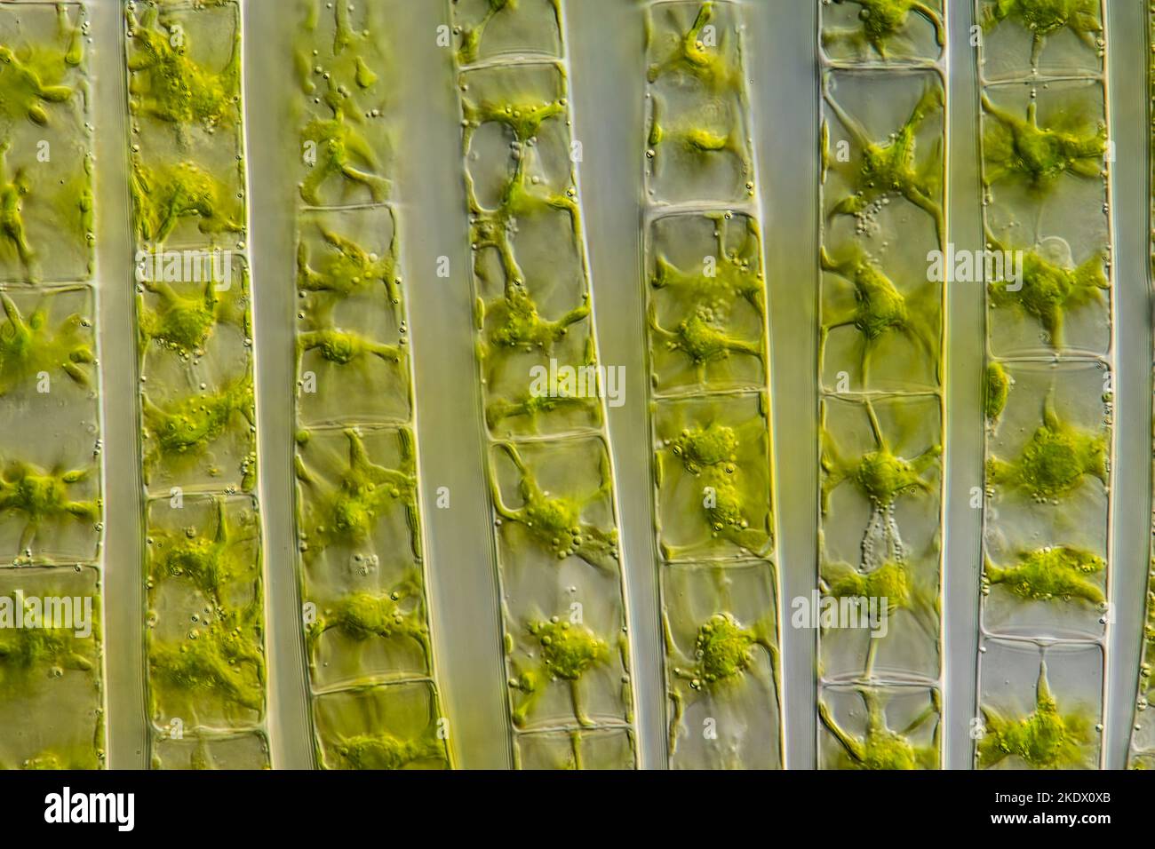 Zygnema sp. algae, light micrograph Stock Photo - Alamy