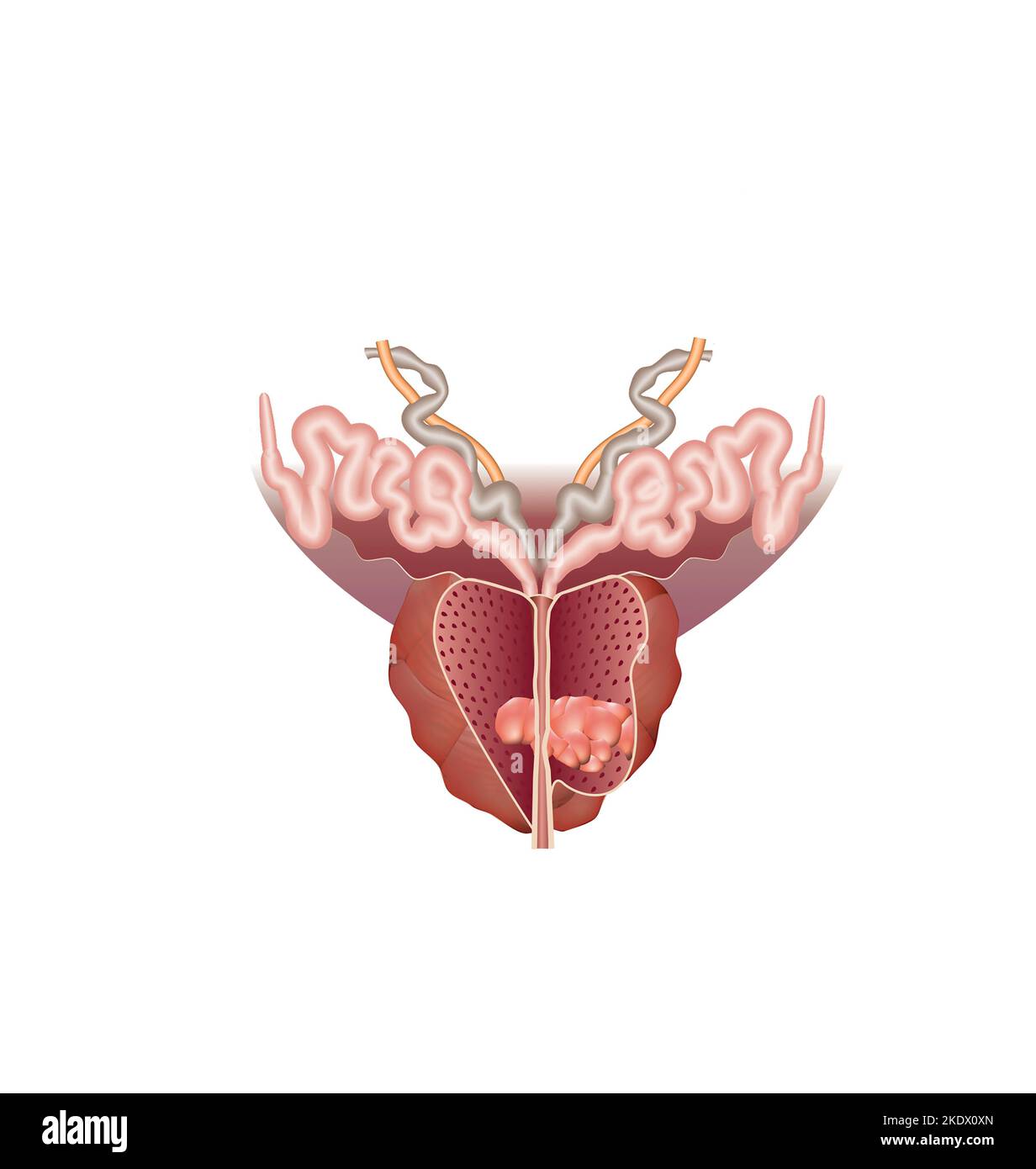 Prostate cancer, illustration Stock Photo - Alamy