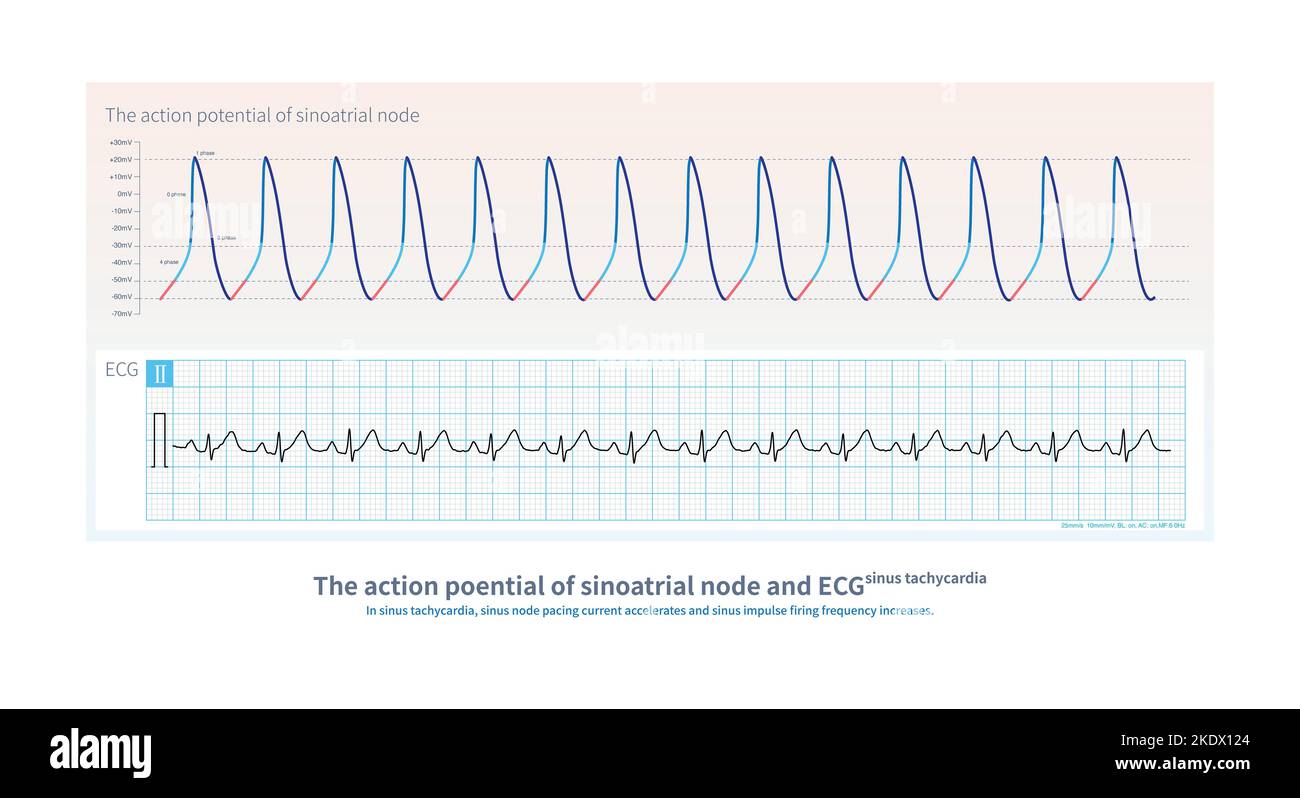 Action potential of sinoatrial node and ECG, illustration Stock Photo ...