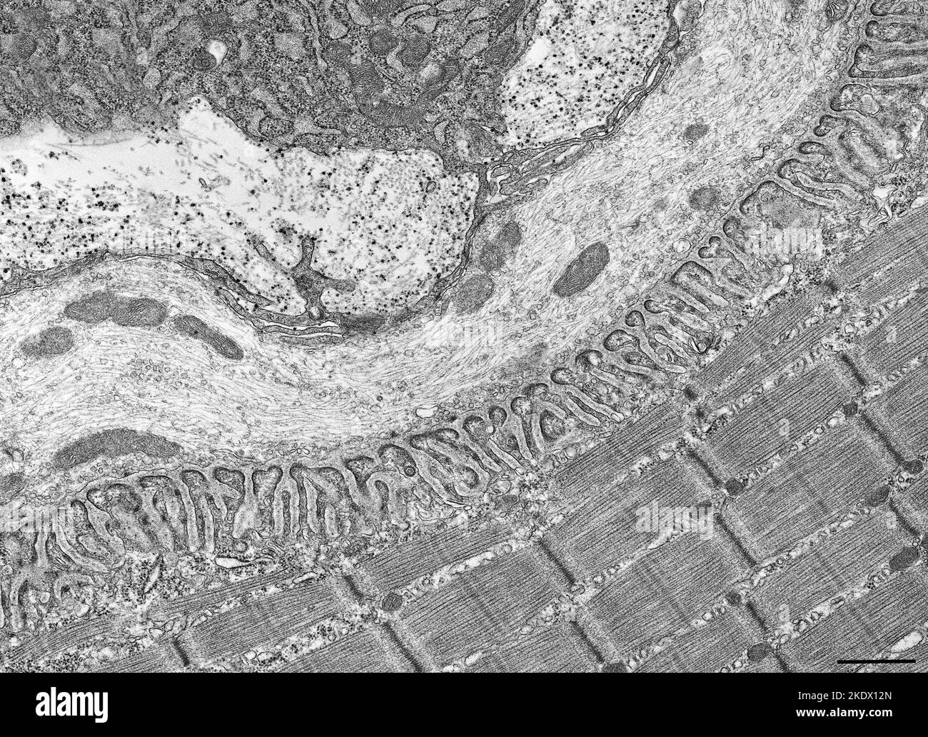 Neuromuscular junction, TEM Stock Photo - Alamy