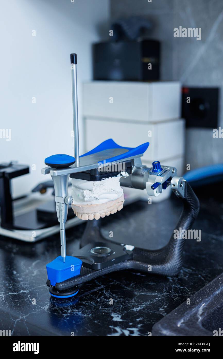 Plaster cast of the jaw with teeth. Modern dental office Stock Photo ...