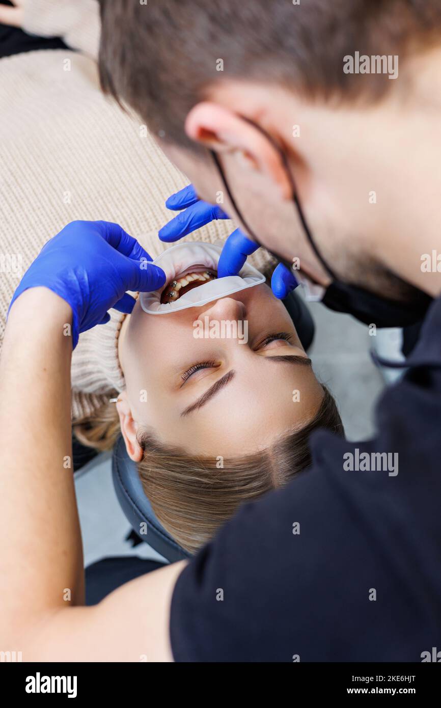 Woman teeth with braces on white teeth. An orthodontist uses dental ...