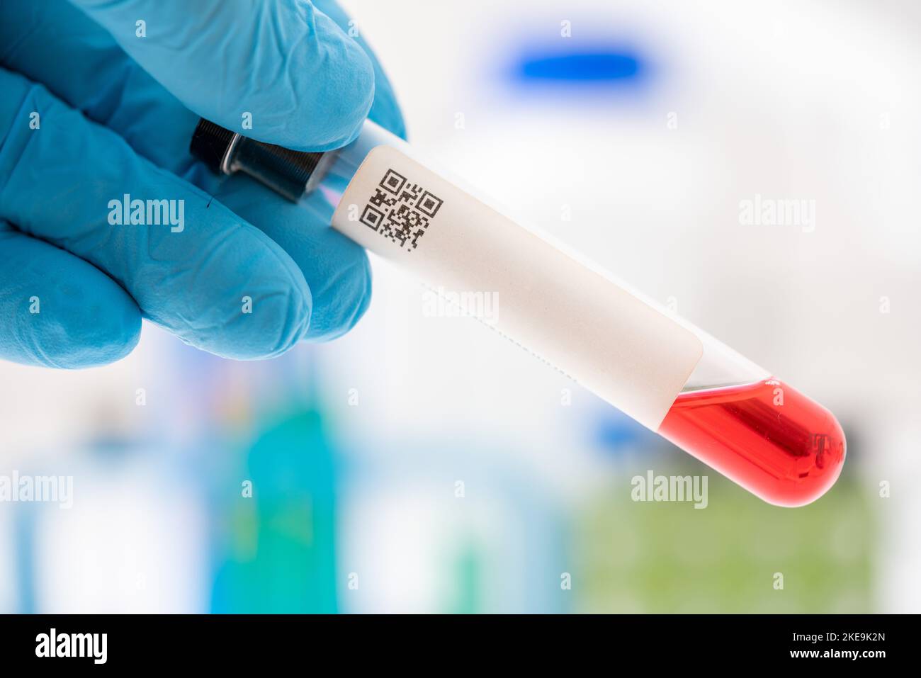 Test tube with blood sample for biochemical analysis in medical ...