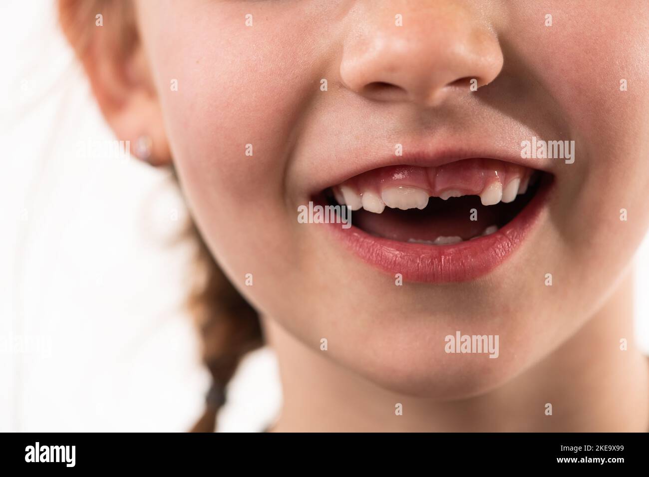 Portrait of a little girl on a white background with healthy ...