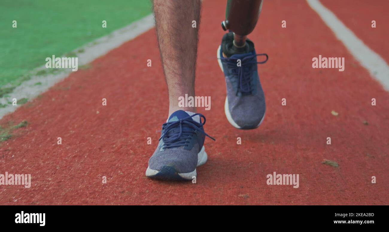 Front view of a disabled athlete walks outdoors with prosthetic leg ...