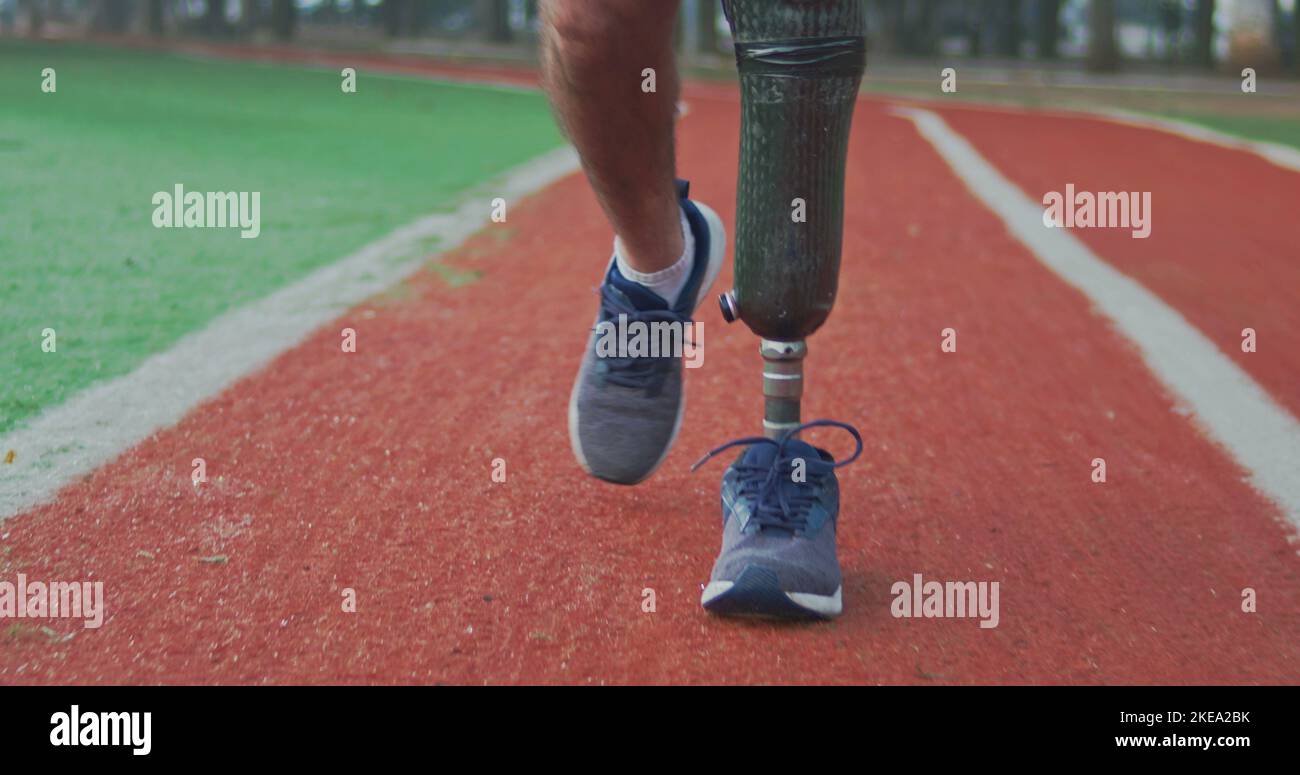 Front view of a disabled athlete man with prosthetic leg walking on ...