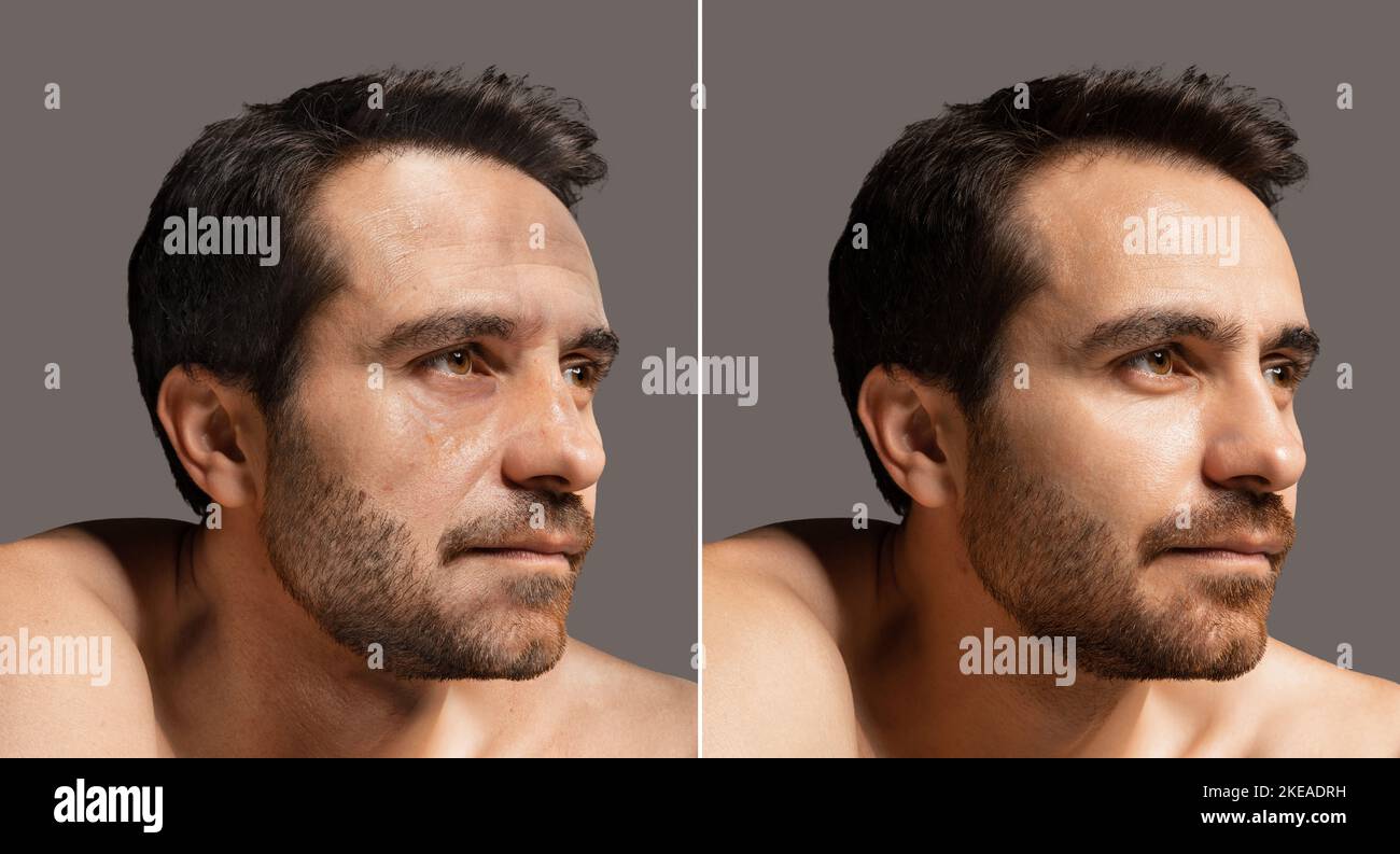 Sagging face hi-res stock photography and images - Alamy