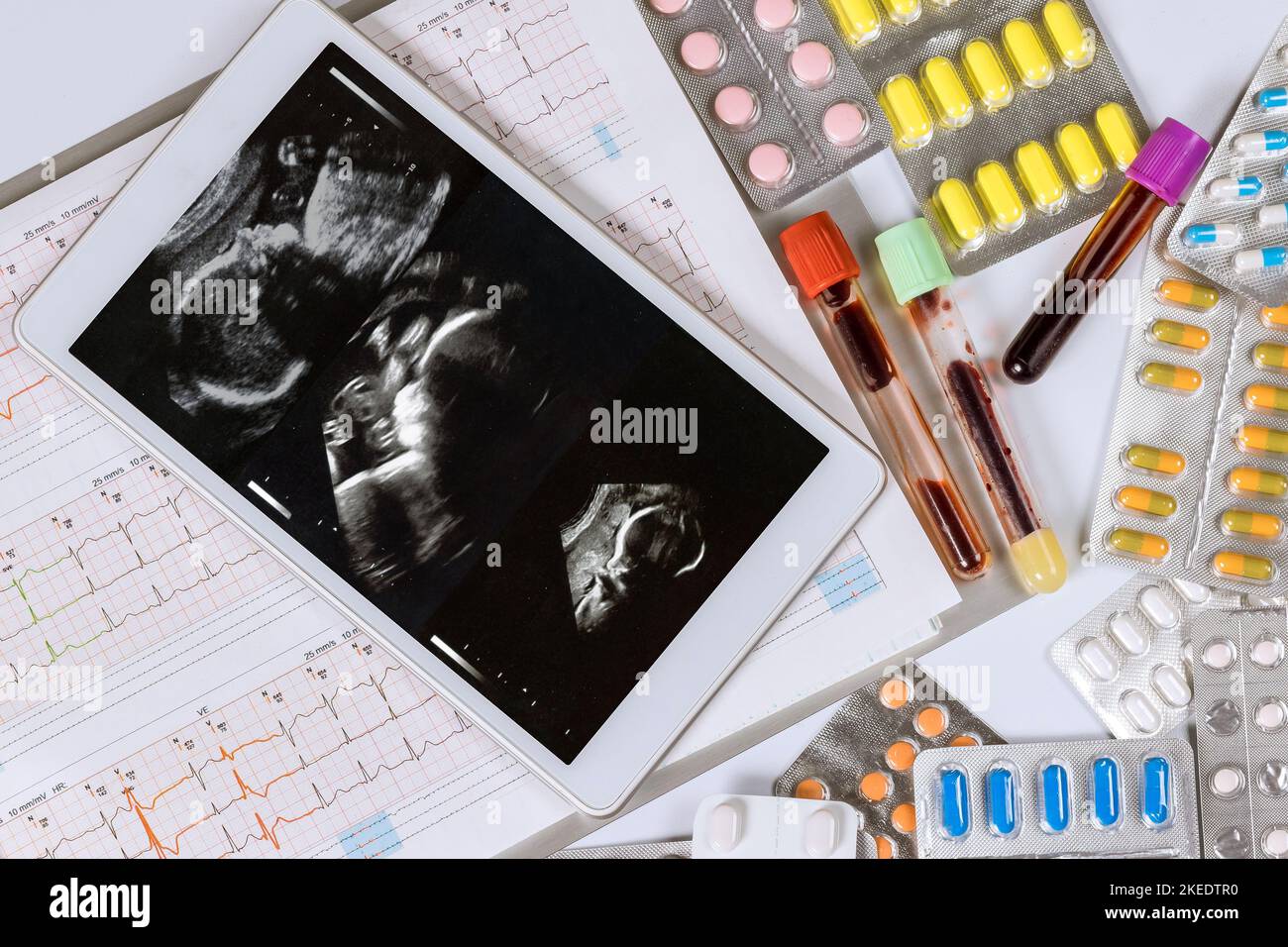 Doctor examines ultrasound and cardiogram of pregnant woman in order to ...