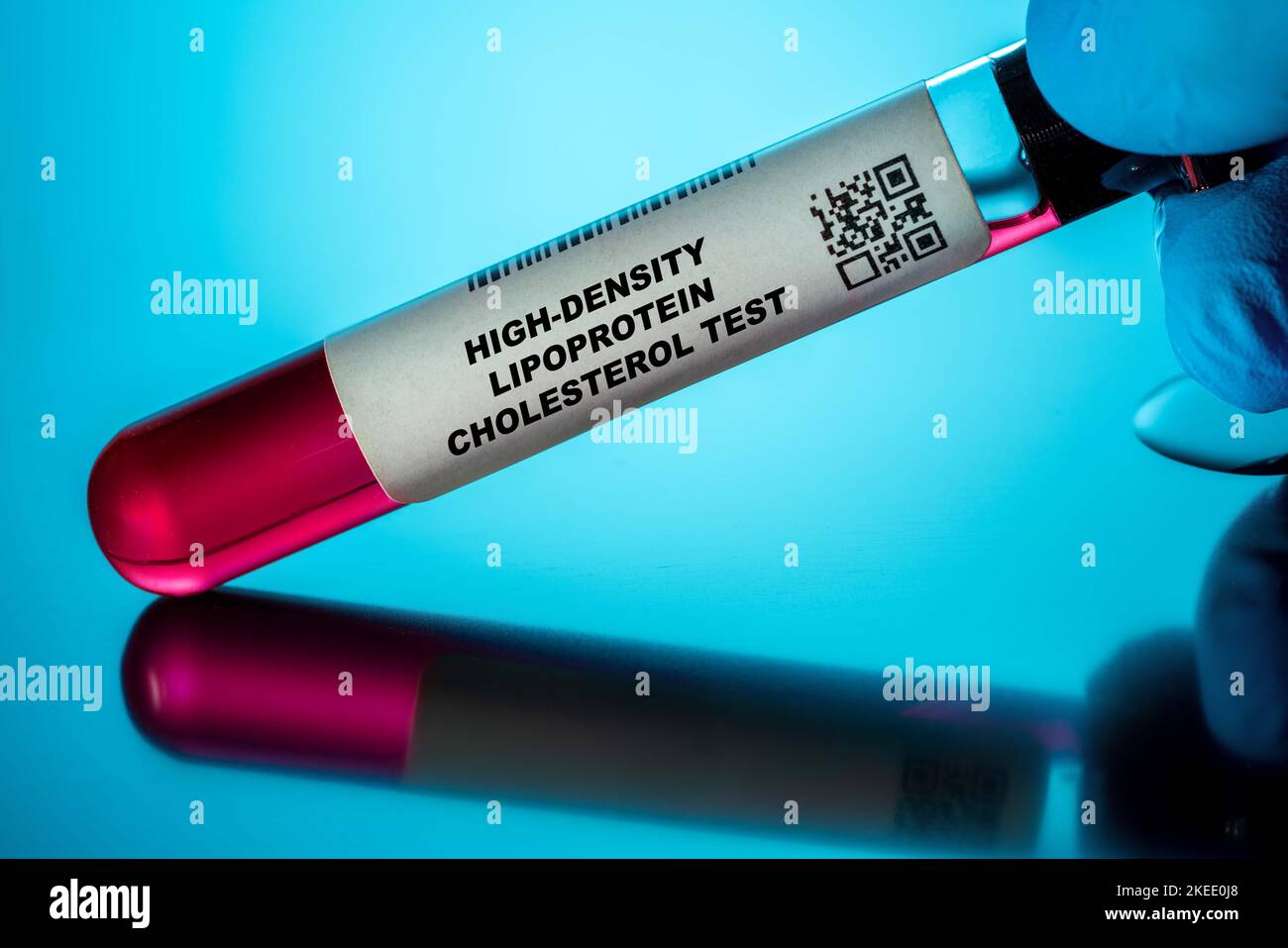 High-Density Lipoprotein Cholesterol Test Blood Tests for Older Adults ...
