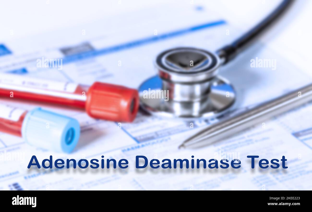 Adenosine deaminase hi-res stock photography and images - Alamy