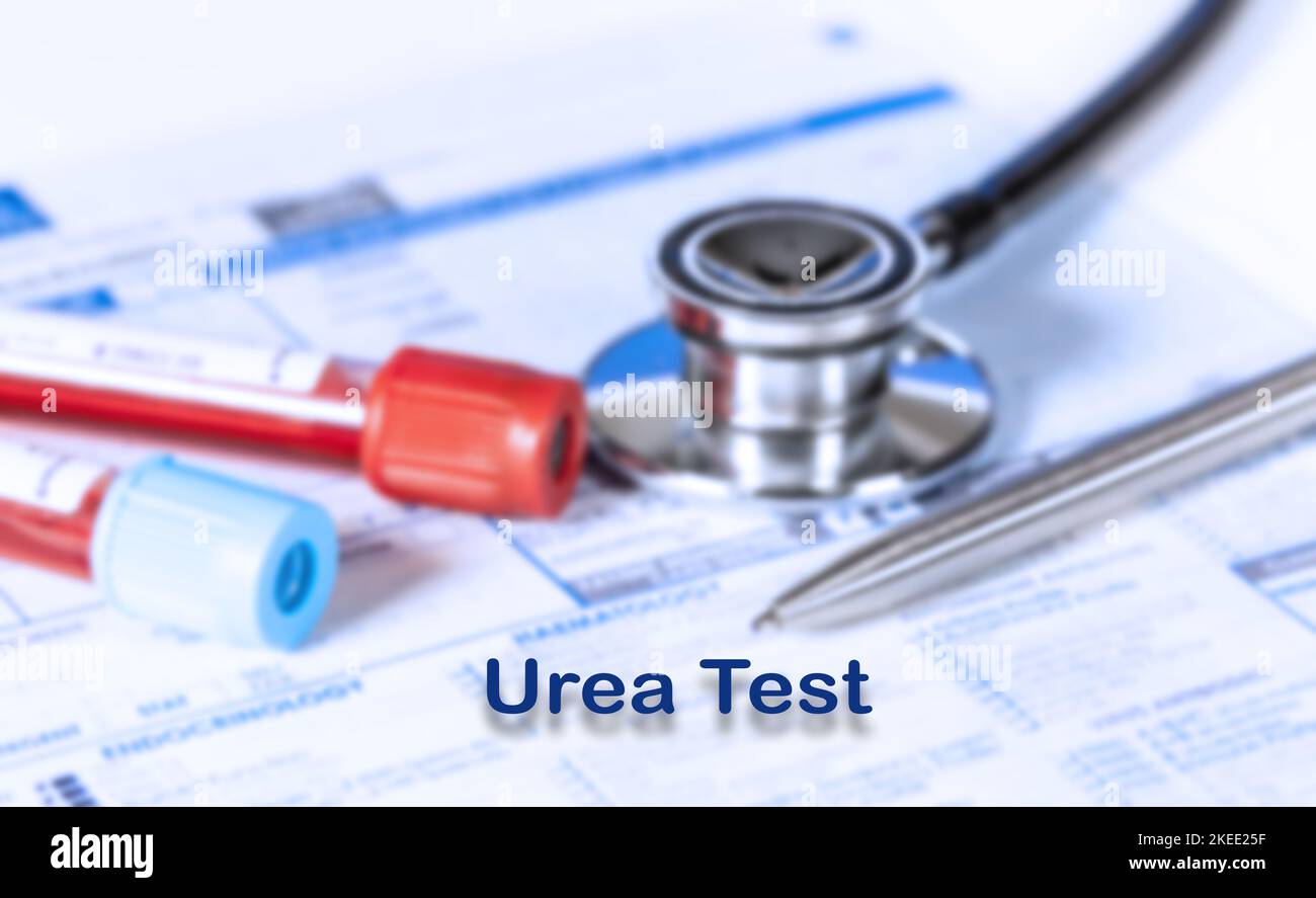 Urea test, conceptual image Stock Photo - Alamy