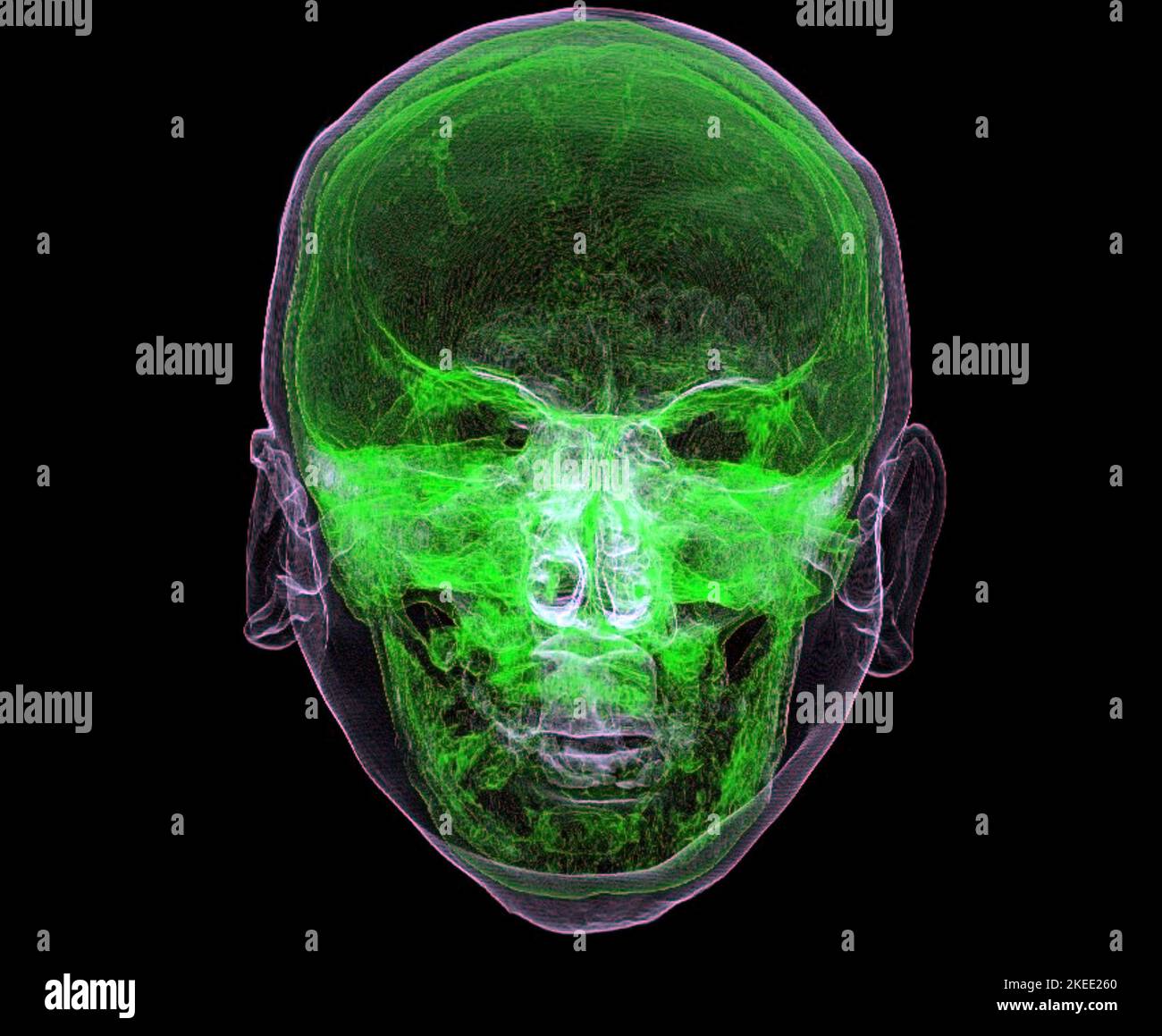 3d ct scan human head hi-res stock photography and images - Alamy