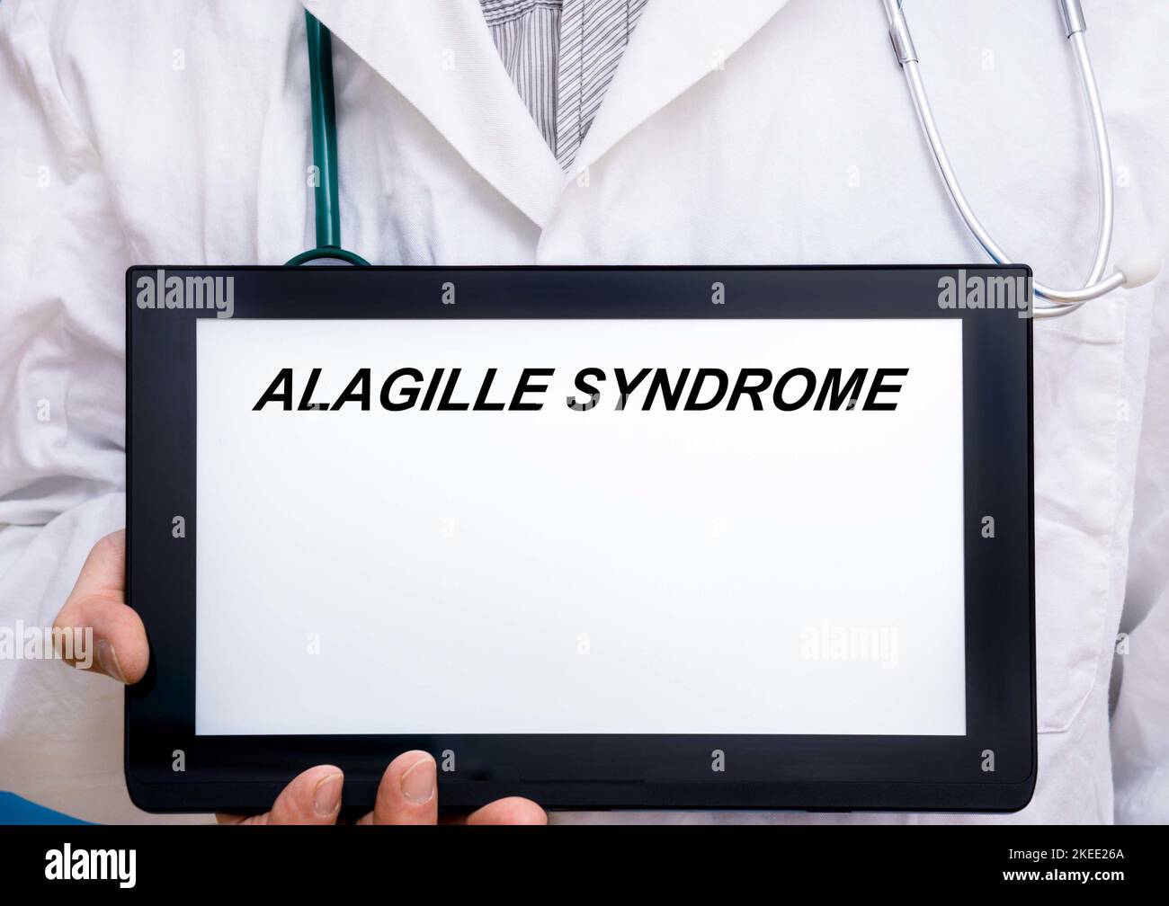 Alagille syndrome, conceptual image Stock Photo - Alamy