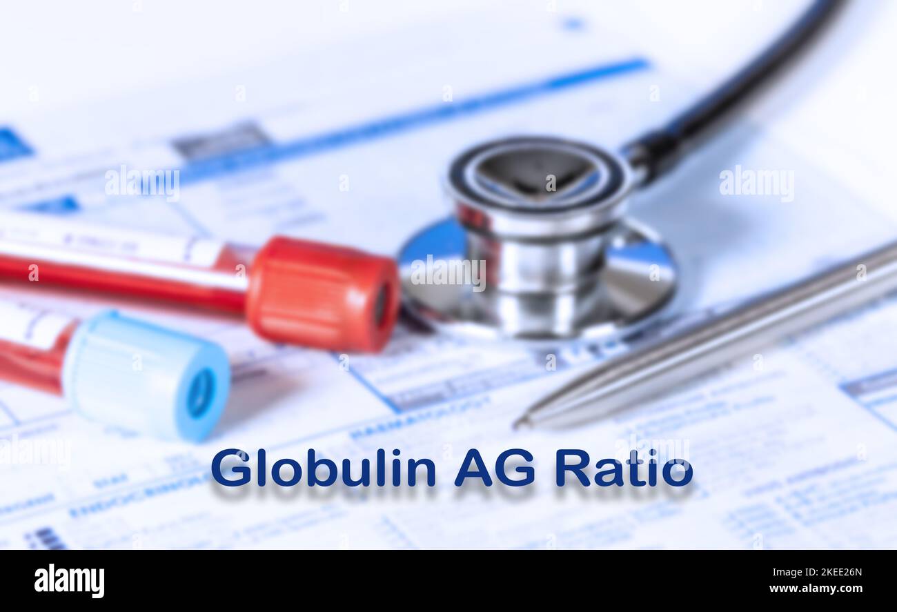 Globulin AG ratio test, conceptual image Stock Photo - Alamy