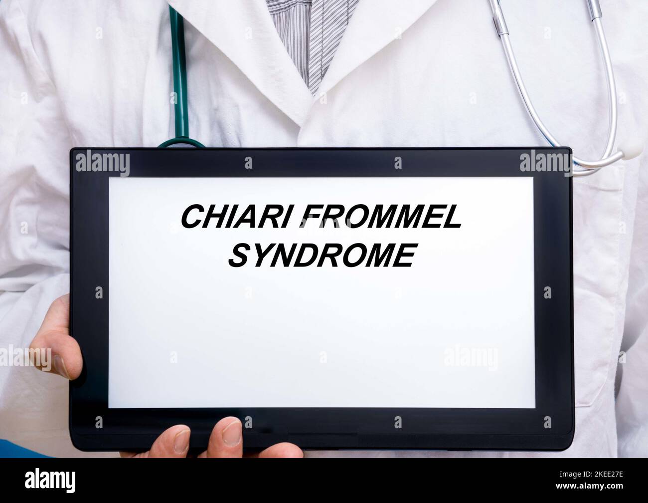 Chiari frommel syndrome disease hi-res stock photography and images - Alamy