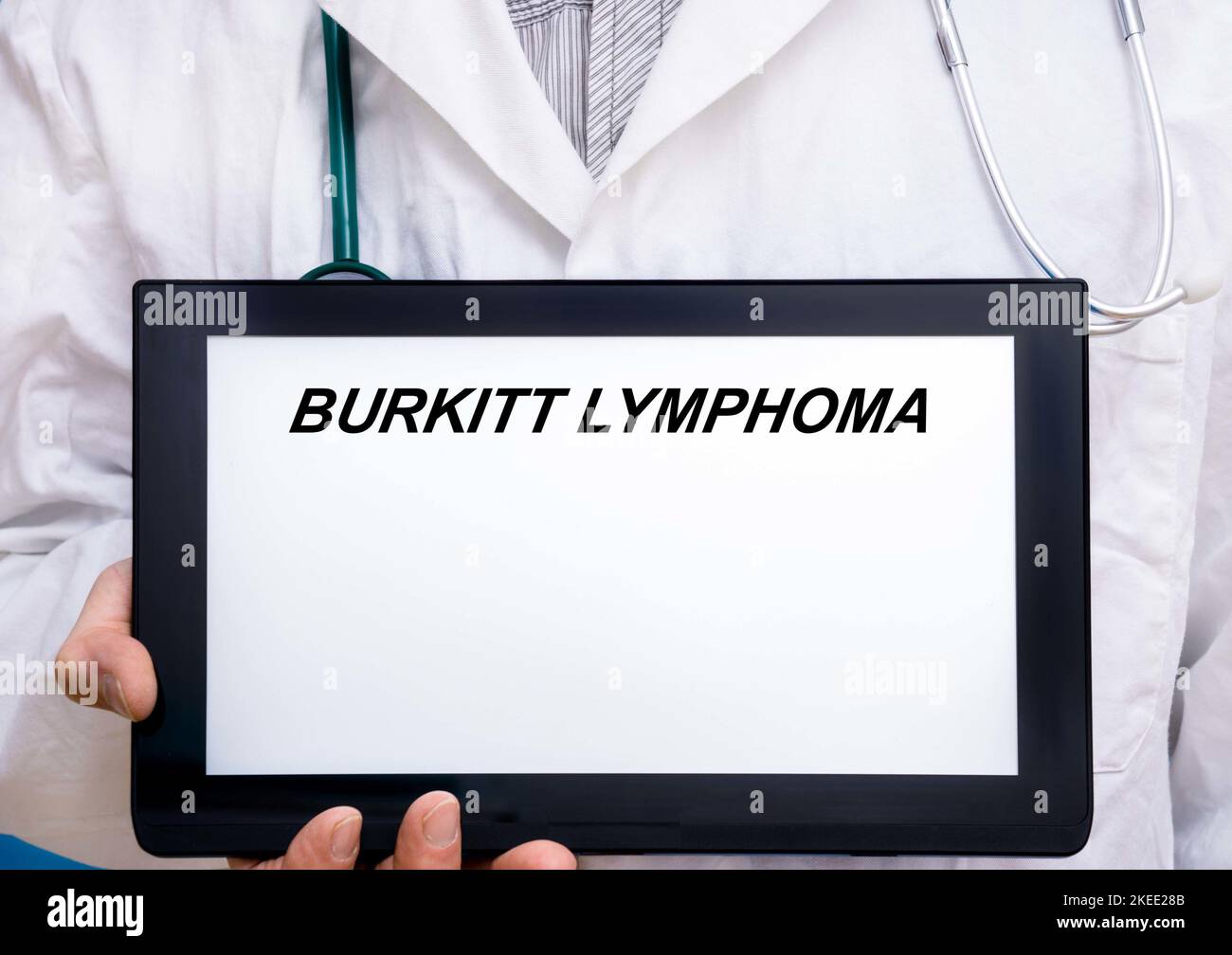 Burkitt lymphoma, conceptual image Stock Photo - Alamy