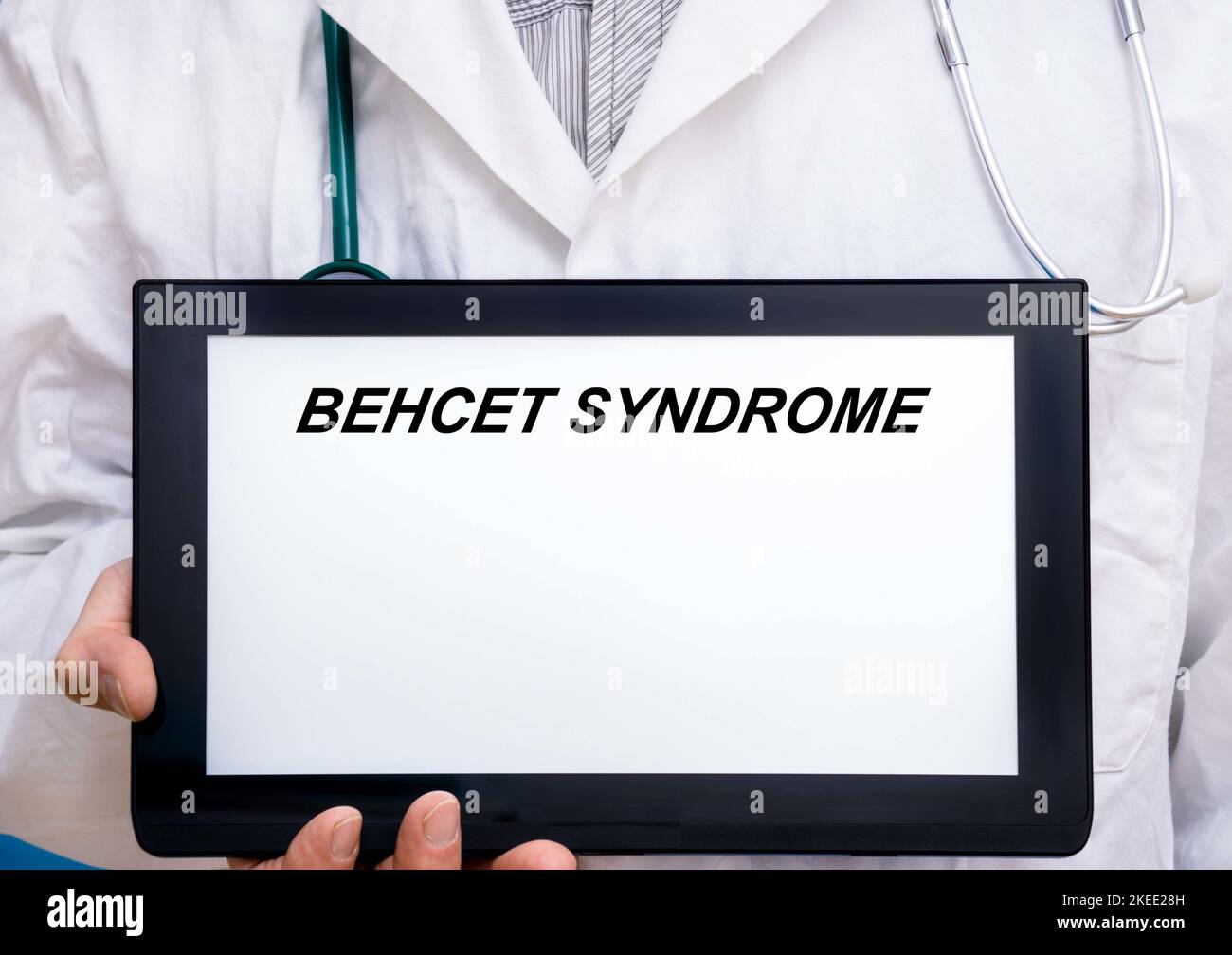 Behcet syndrome hi-res stock photography and images - Alamy