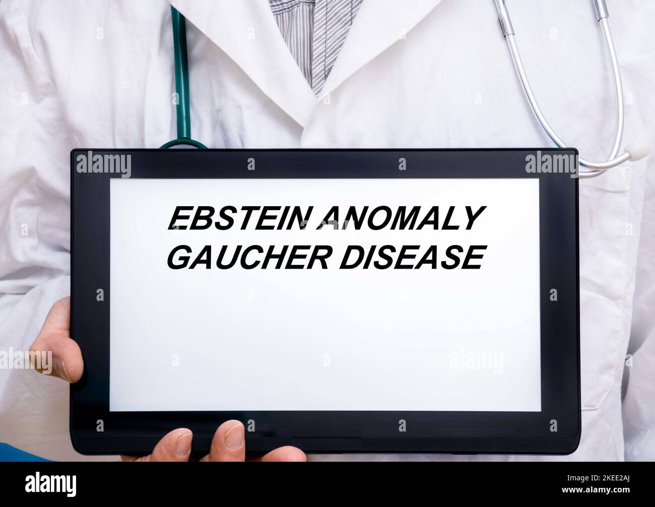 Gaucher disease, conceptual image Stock Photo - Alamy