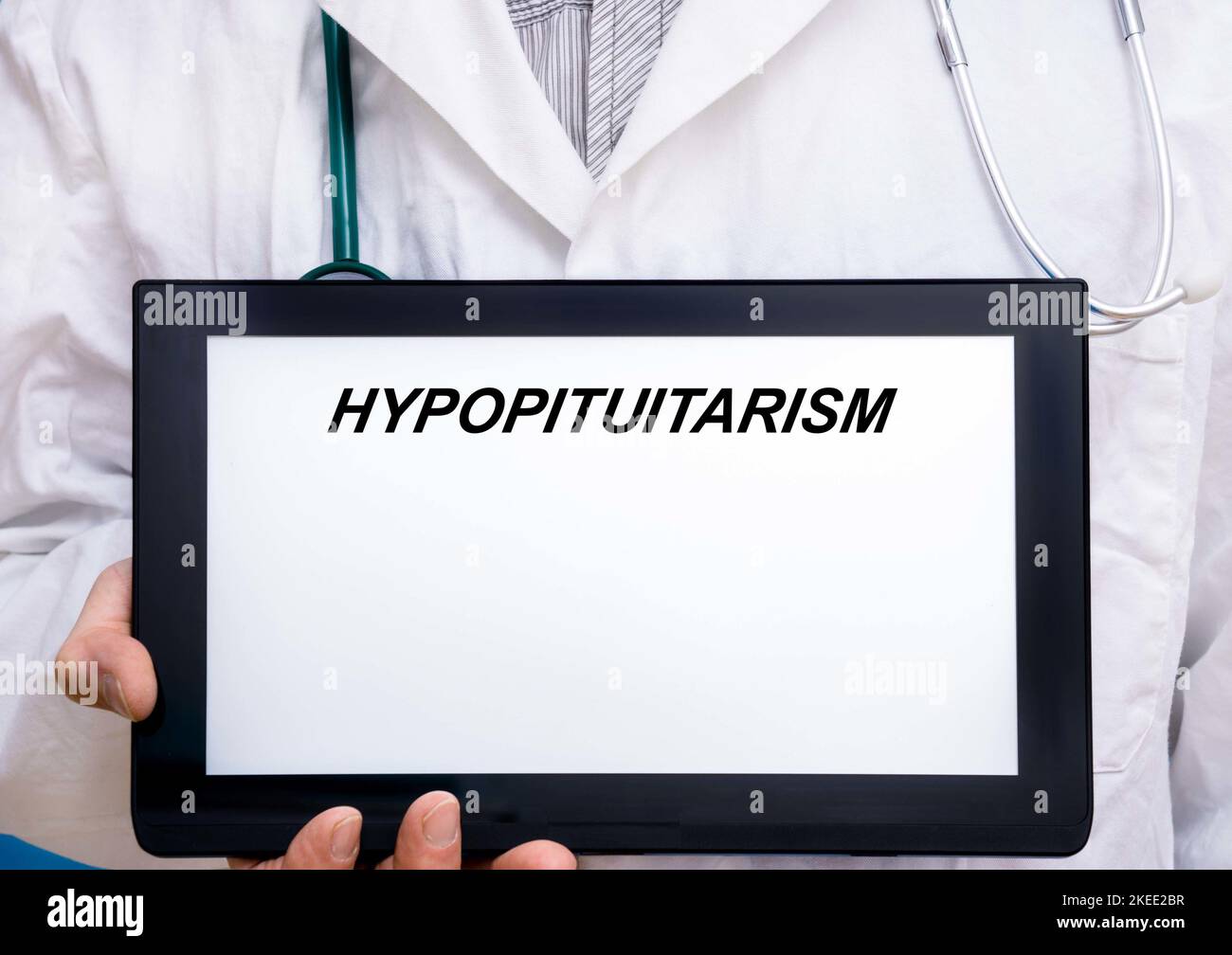 Hypopituitarism, conceptual image Stock Photo - Alamy
