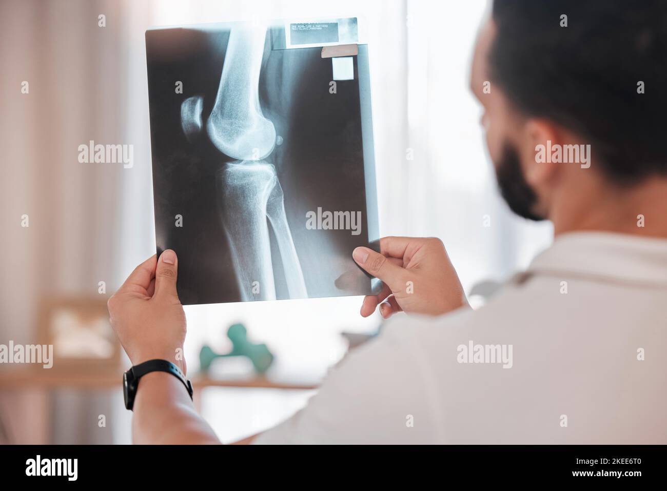 Health, x ray and physiotherapy, man physiotherapist check medical ...