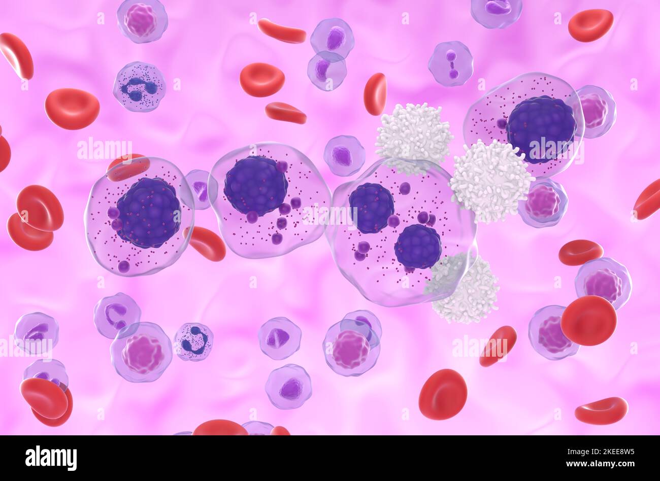 T-cells attack multiple myeloma cells in the blood flow - closeup view ...