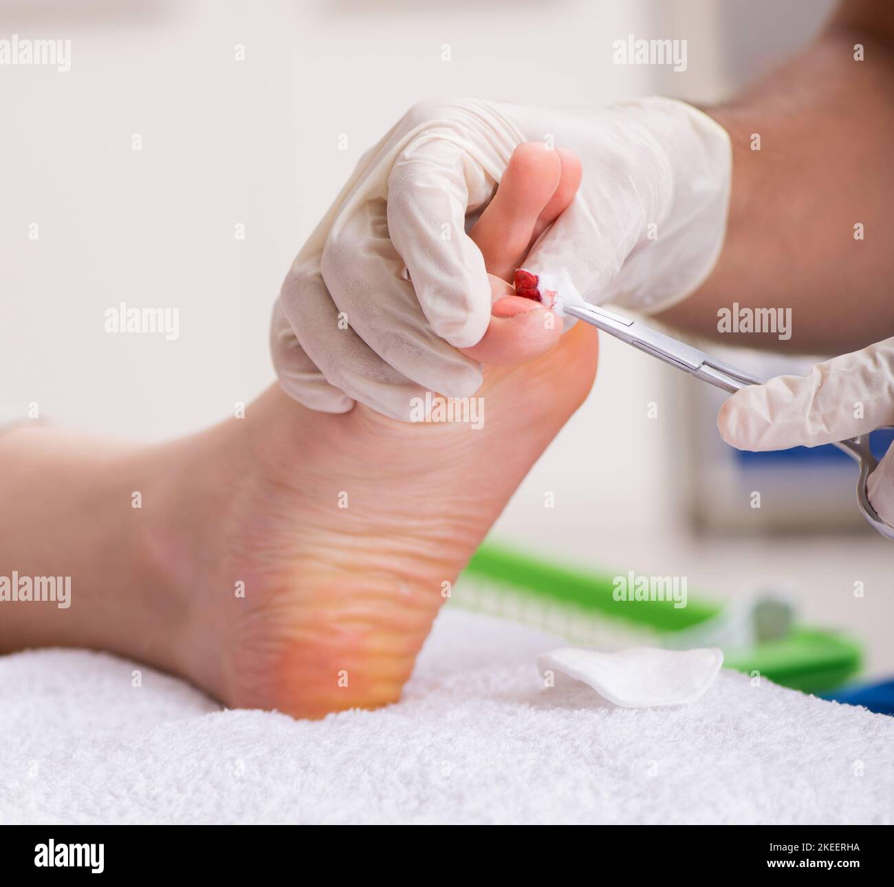 The podiatrist treating feet during procedure Stock Photo - Alamy