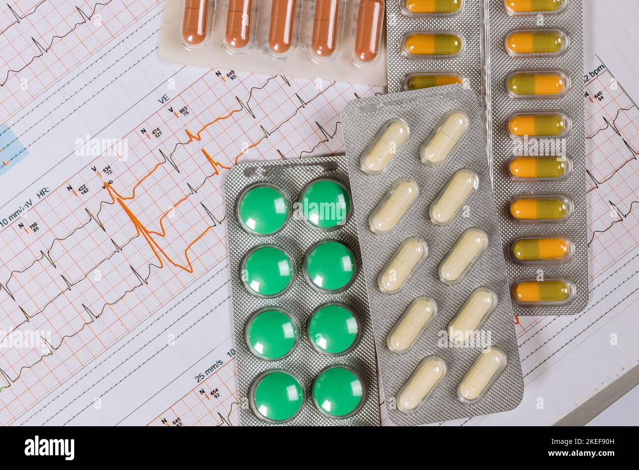 In course of examining cardiogram that doctor has prescribed for heart ...