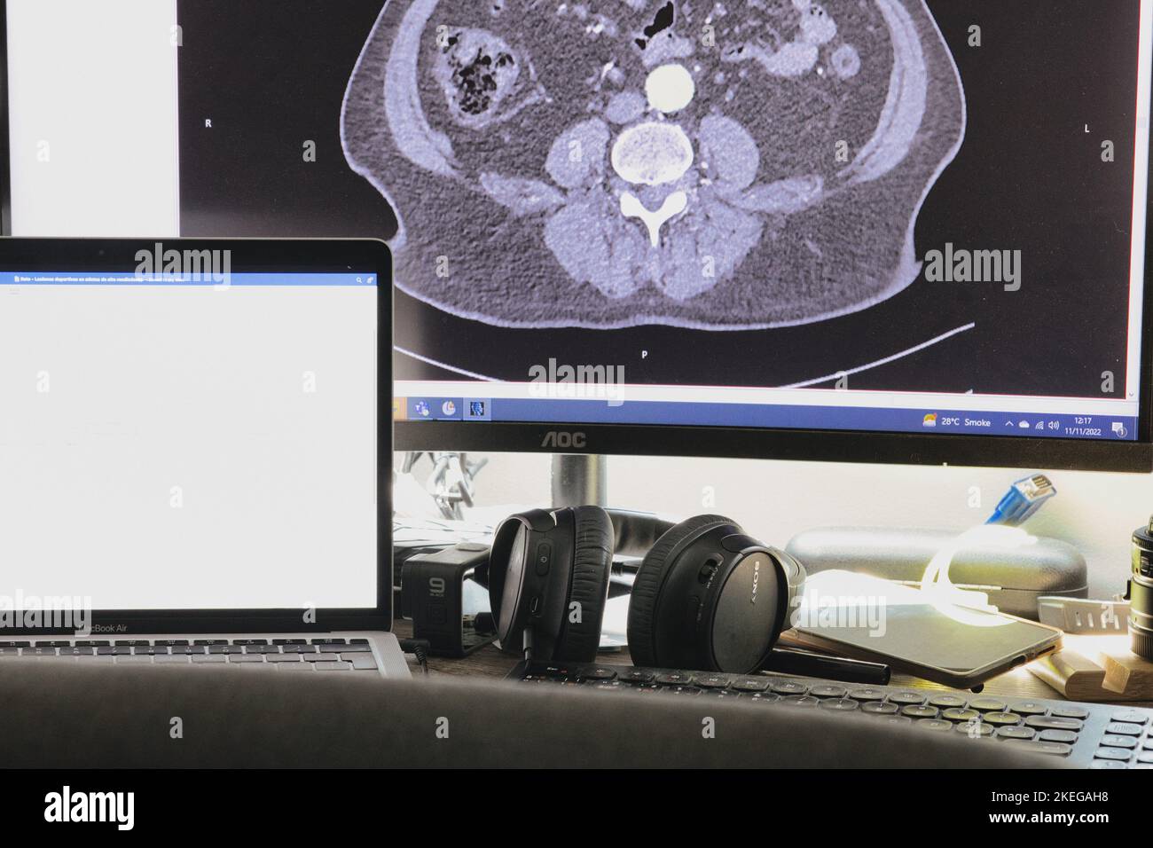 Mri ctscan hi-res stock photography and images - Alamy