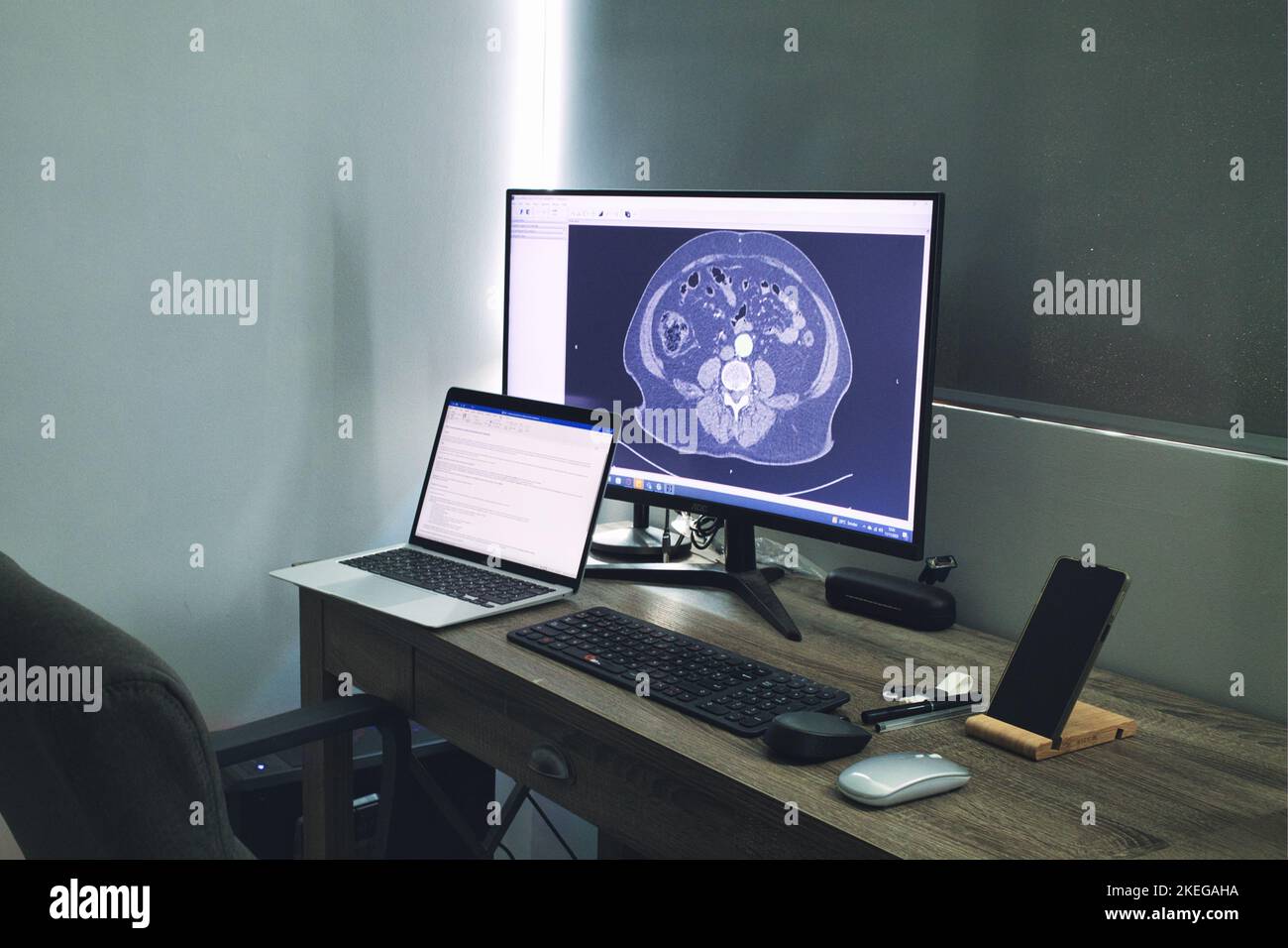 Tissue segmentation hi-res stock photography and images - Alamy