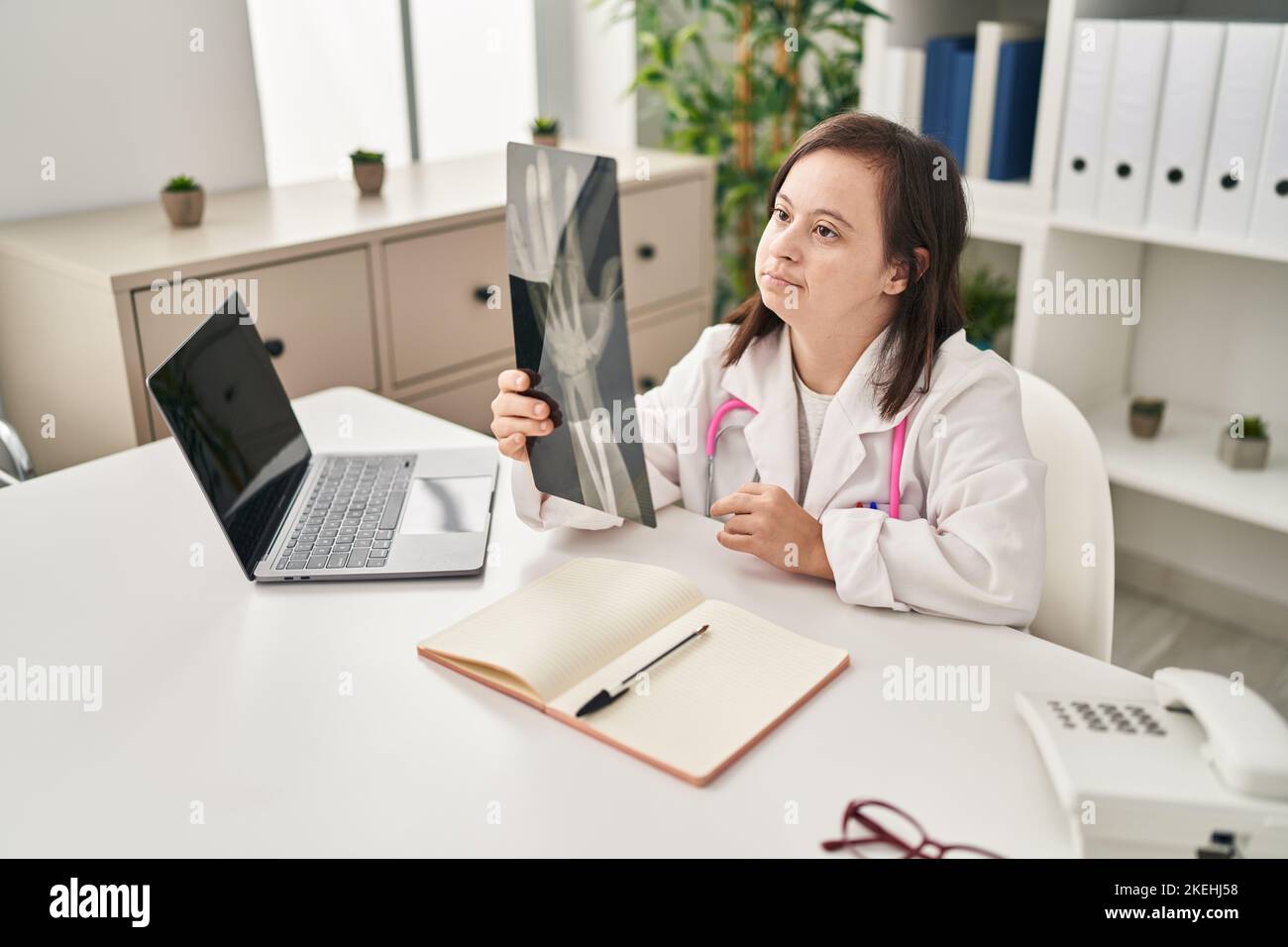 Down syndrome woman wearing doctor uniform holding x-ray at clinic ...