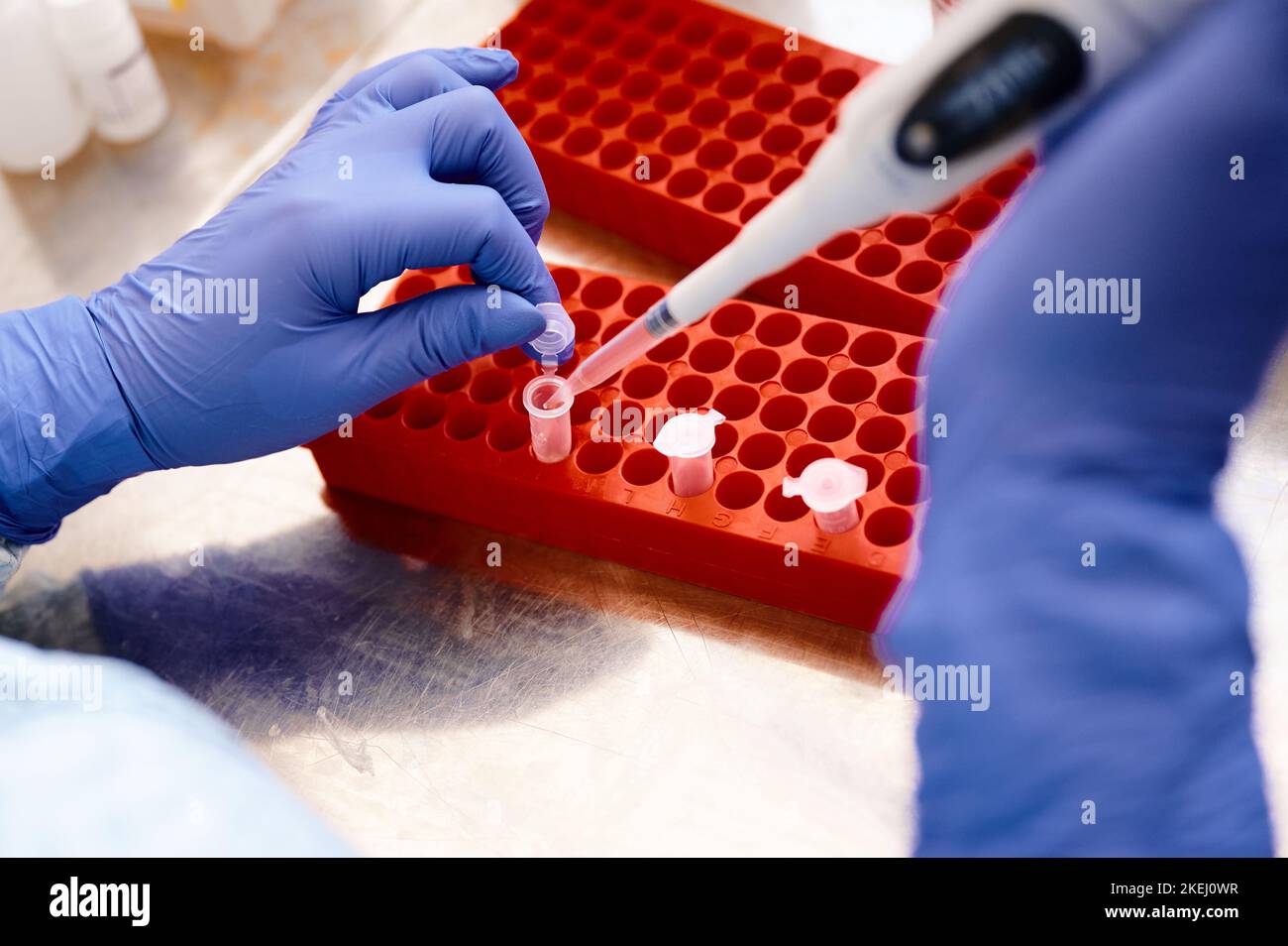 Bacterial identification hi-res stock photography and images - Alamy
