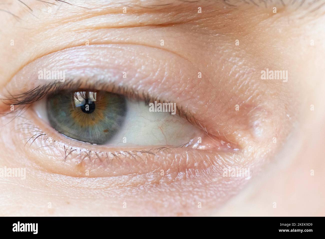 eye close-up on a face that is not young, eyes with poor vision ...