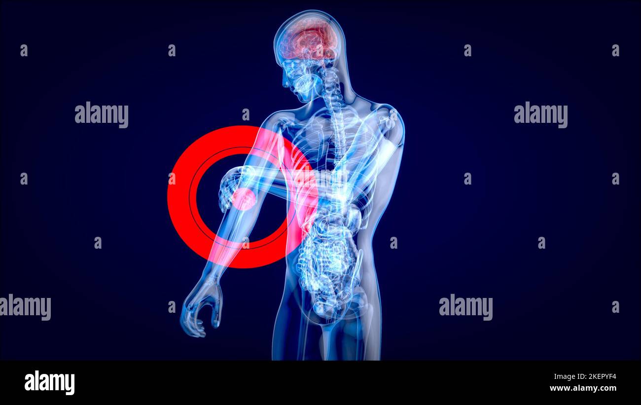 4K anatomy concept of an elbow pain Stock Photo - Alamy