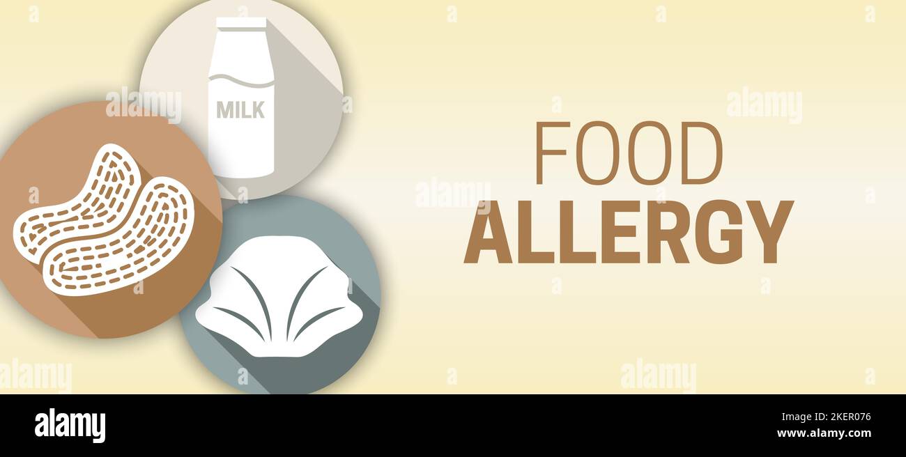 Food Allergy Illustration Background with Milk, Peanuts and Shellfish ...