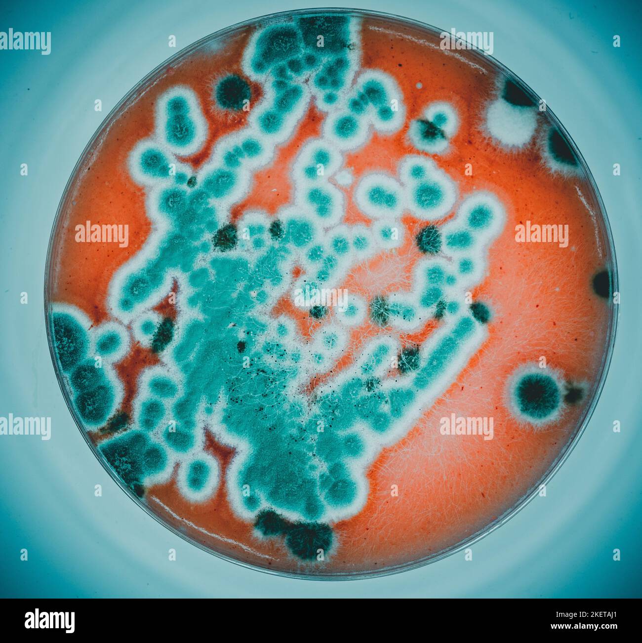 colonies of microorganisms on the surface of agar in a Petri dish ...