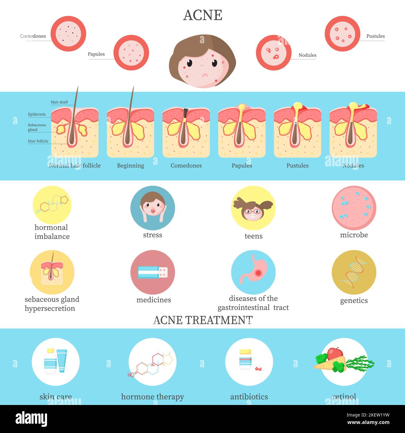 Skin illustration diagram disease cartoon hi-res stock photography and ...